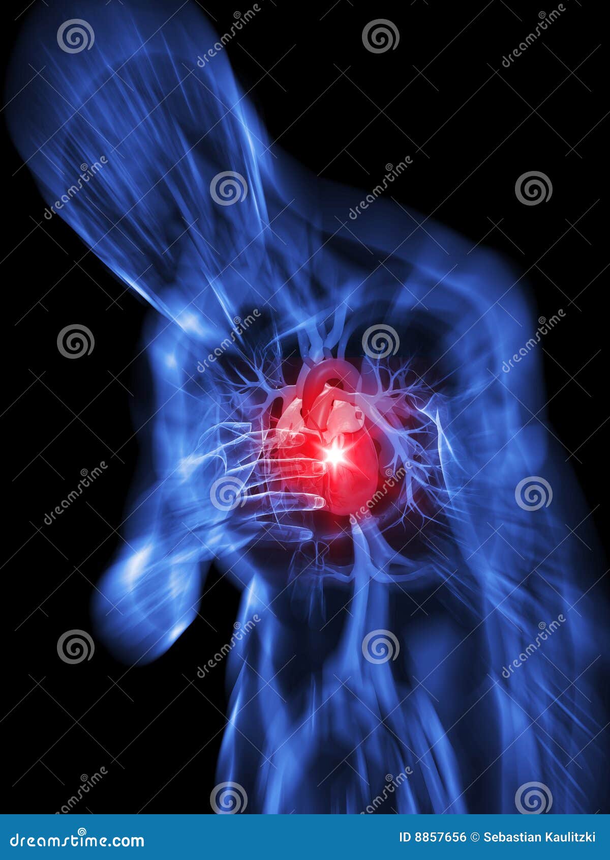 Heart attack stock illustration. Illustration of hospital - 8857656