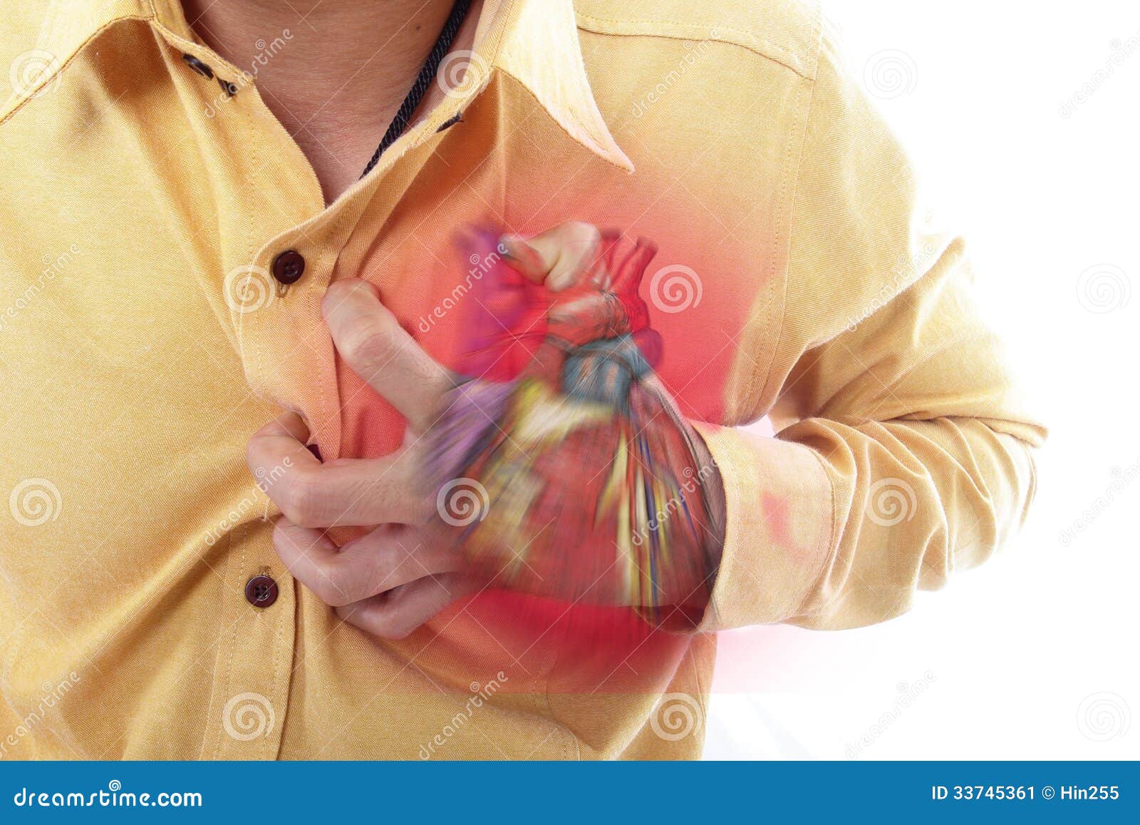 Heart Attack Concept by Use Hand Grabbing a Chest Imagem de Stock ...