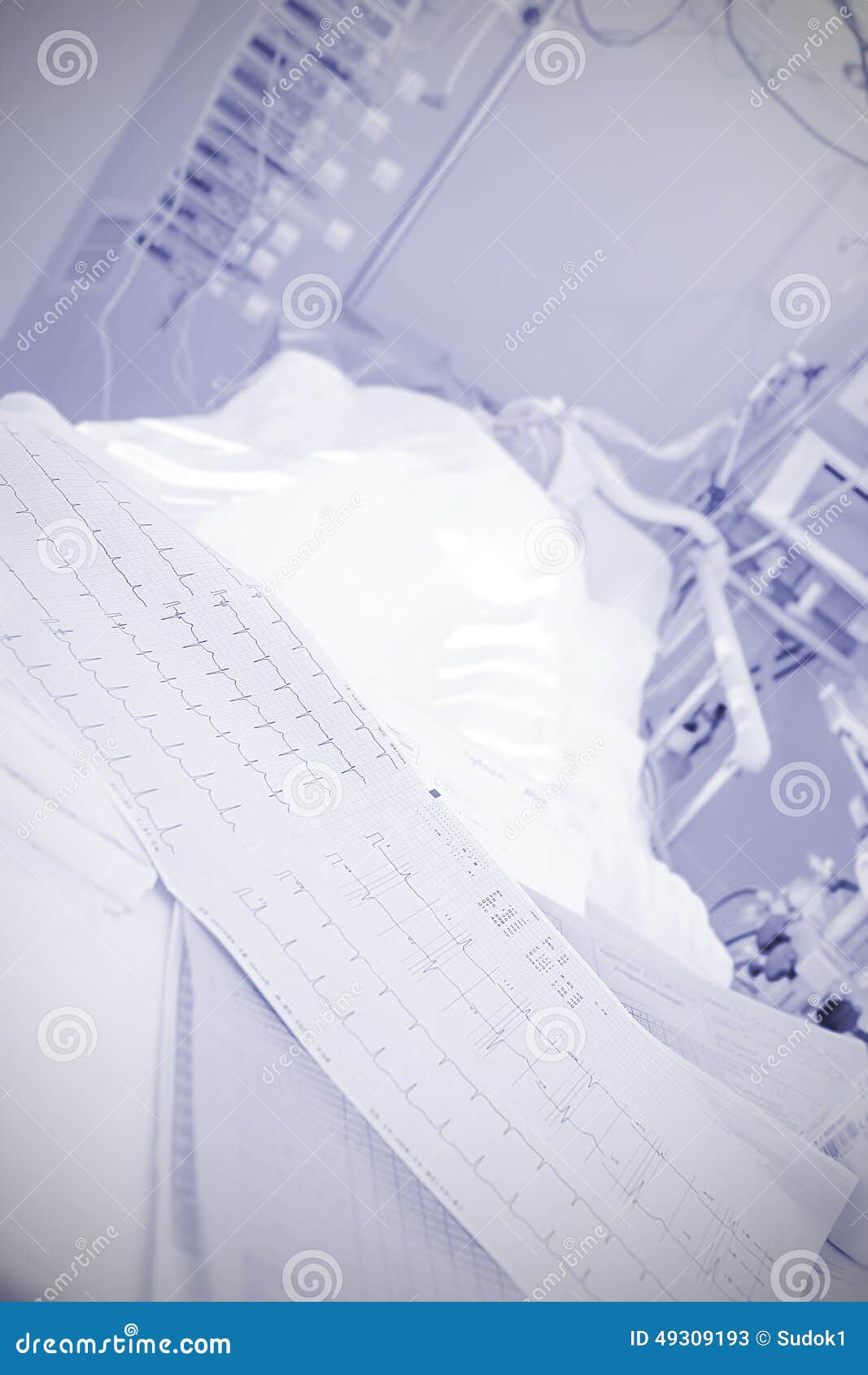 Heart Attack in the ICU. ECG of Heavy Patient Stock Image - Image of ...