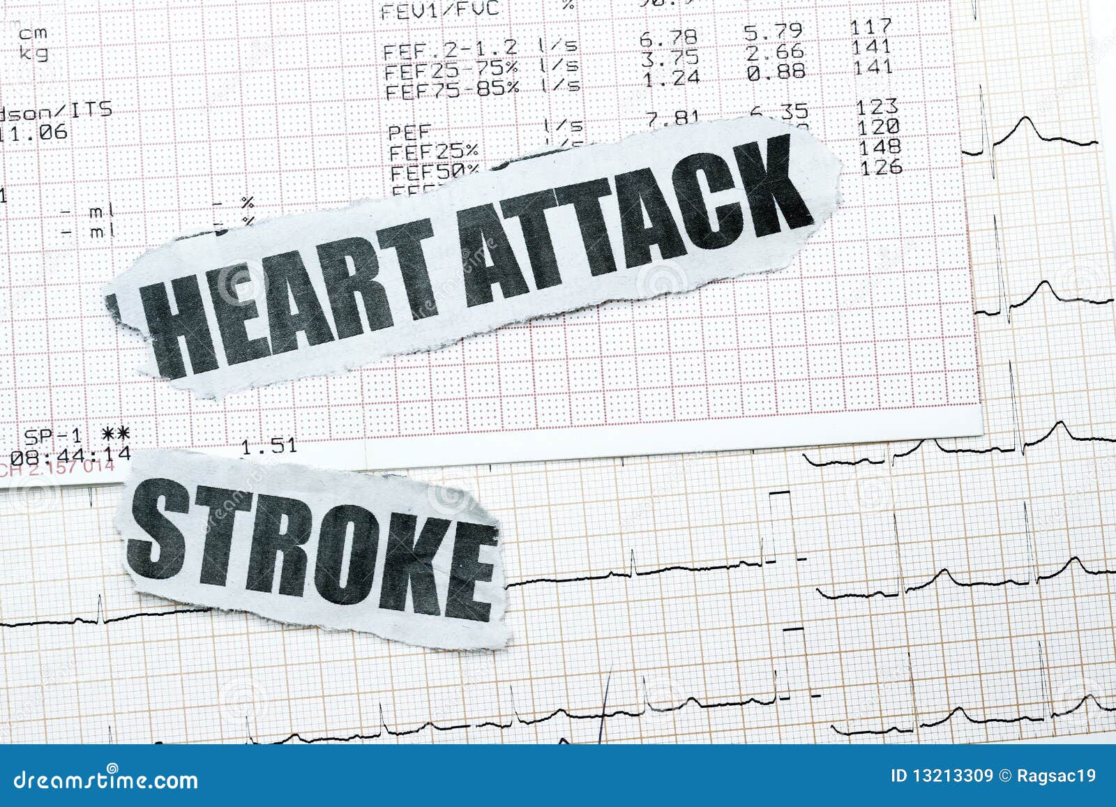 Heart attack and stroke stock image. Image of ischemic - 13213309