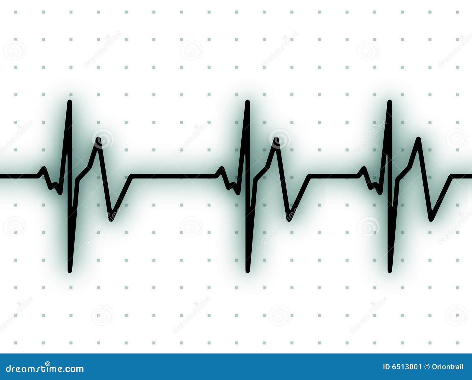 Heart Beat On ECG Screen Stock Image - Image: 6513001