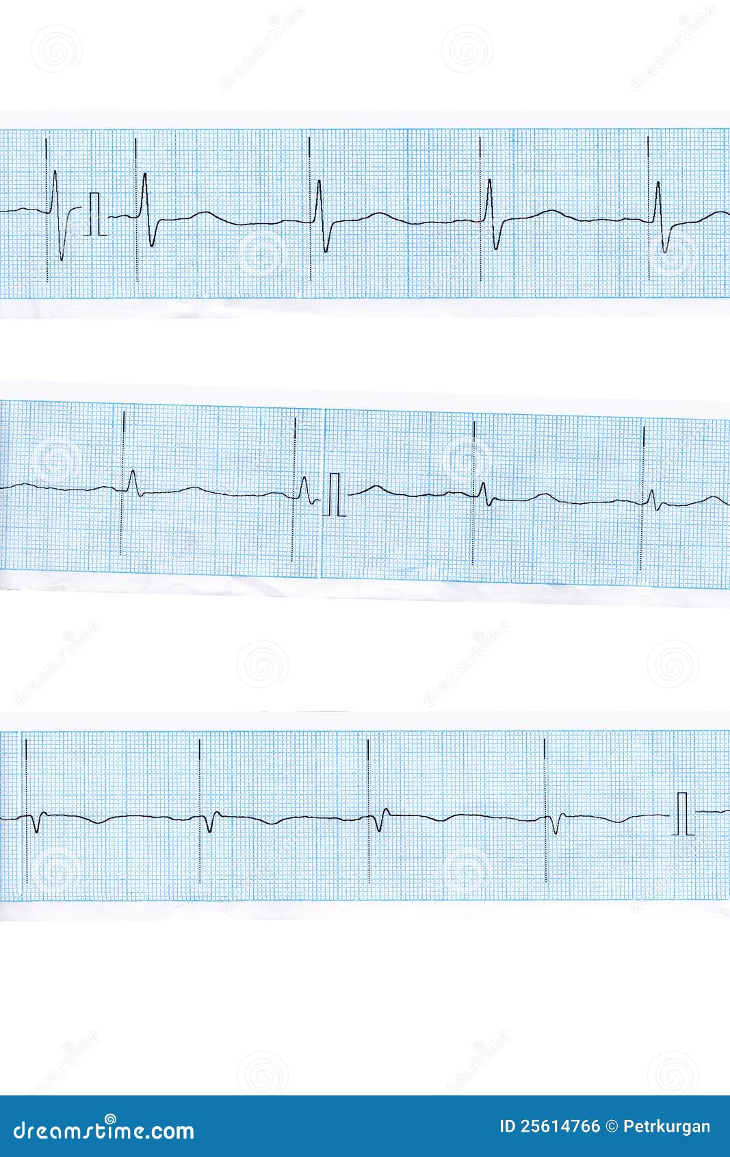 Heart. Blue cardiogram stock photo. Image of medicine - 25614766