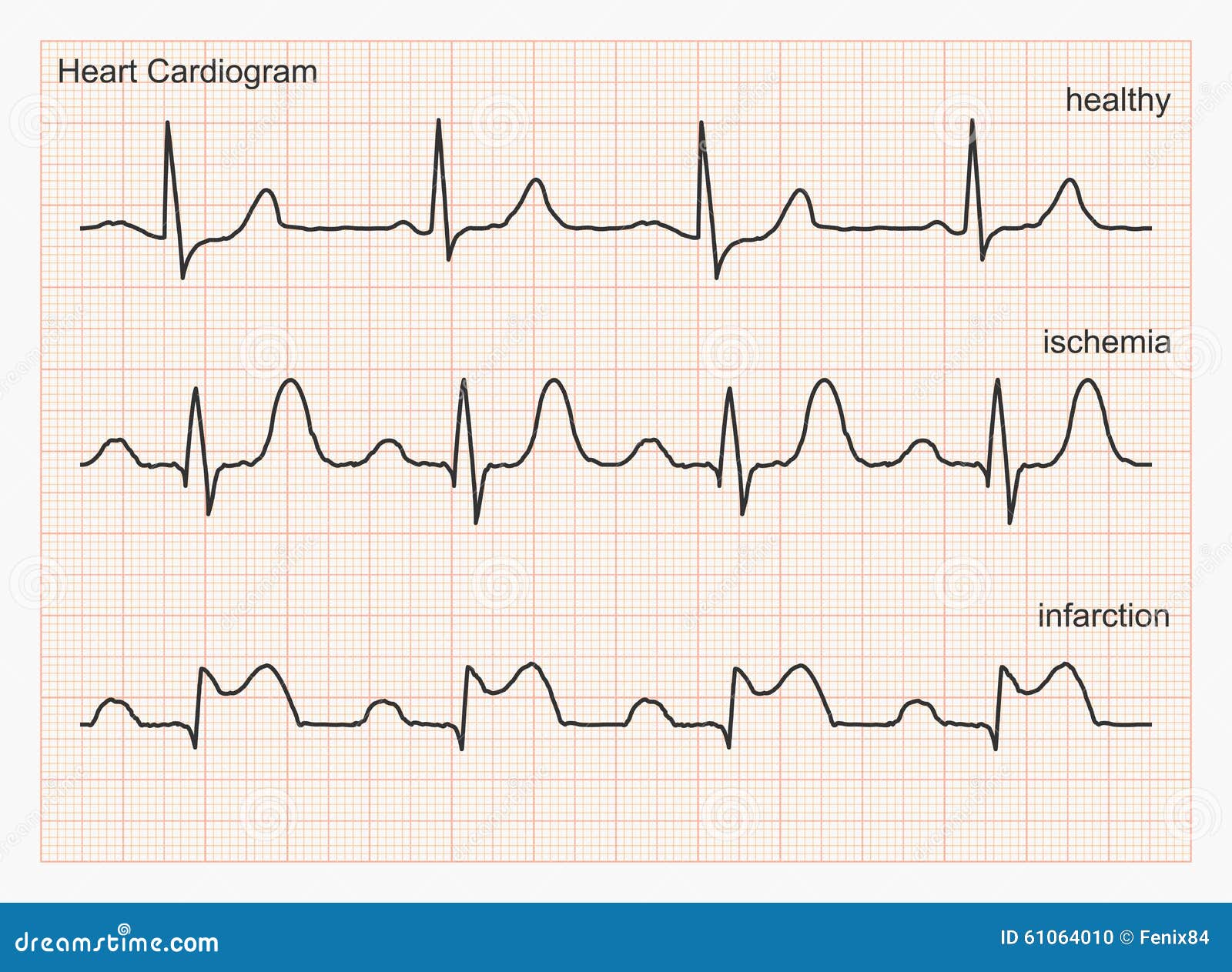 Heart Cardiogram Waves Stock Vector Illustration Of Cardiograms