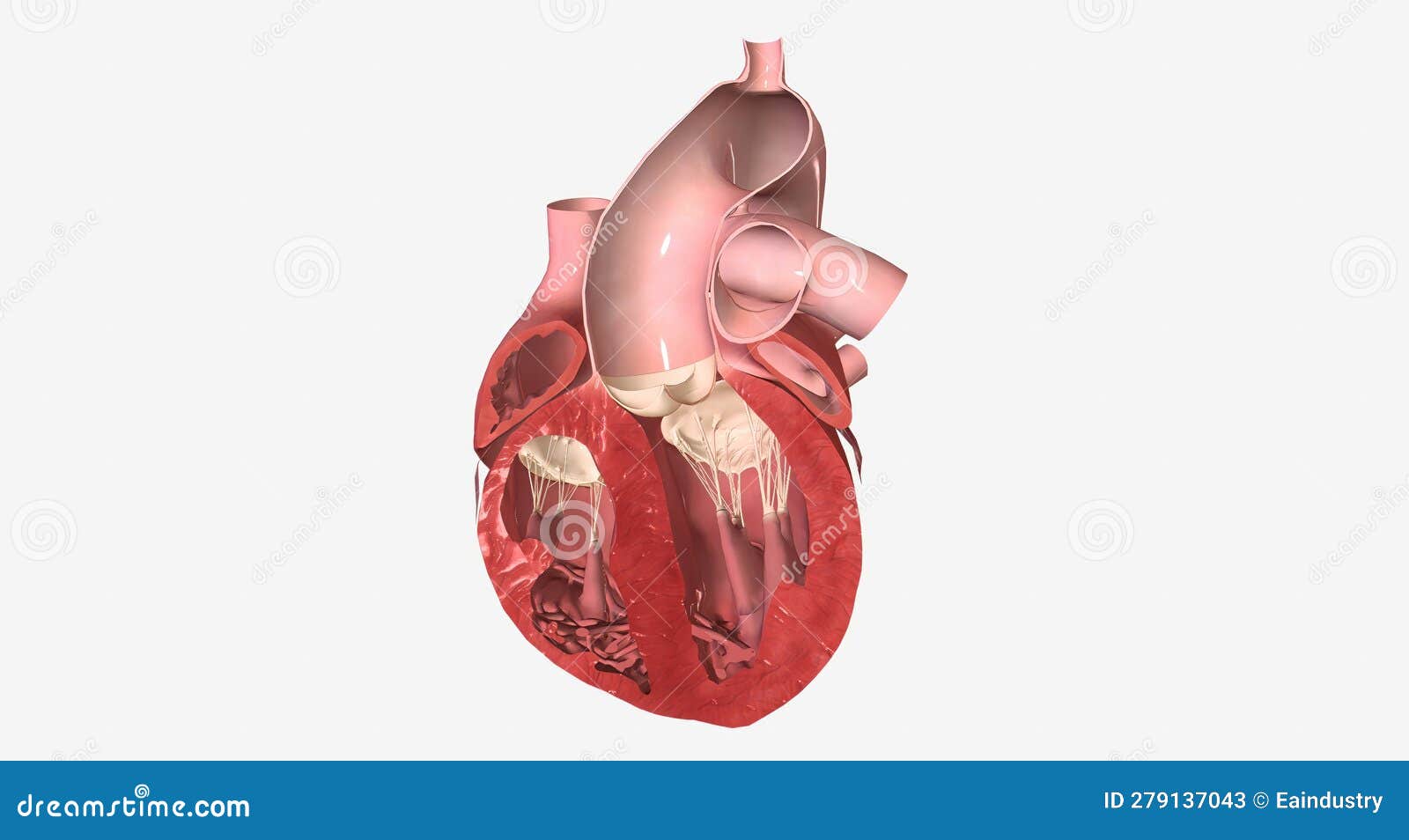 CT Chest Coronal MIP View Royalty-Free Stock Photo | CartoonDealer.com ...