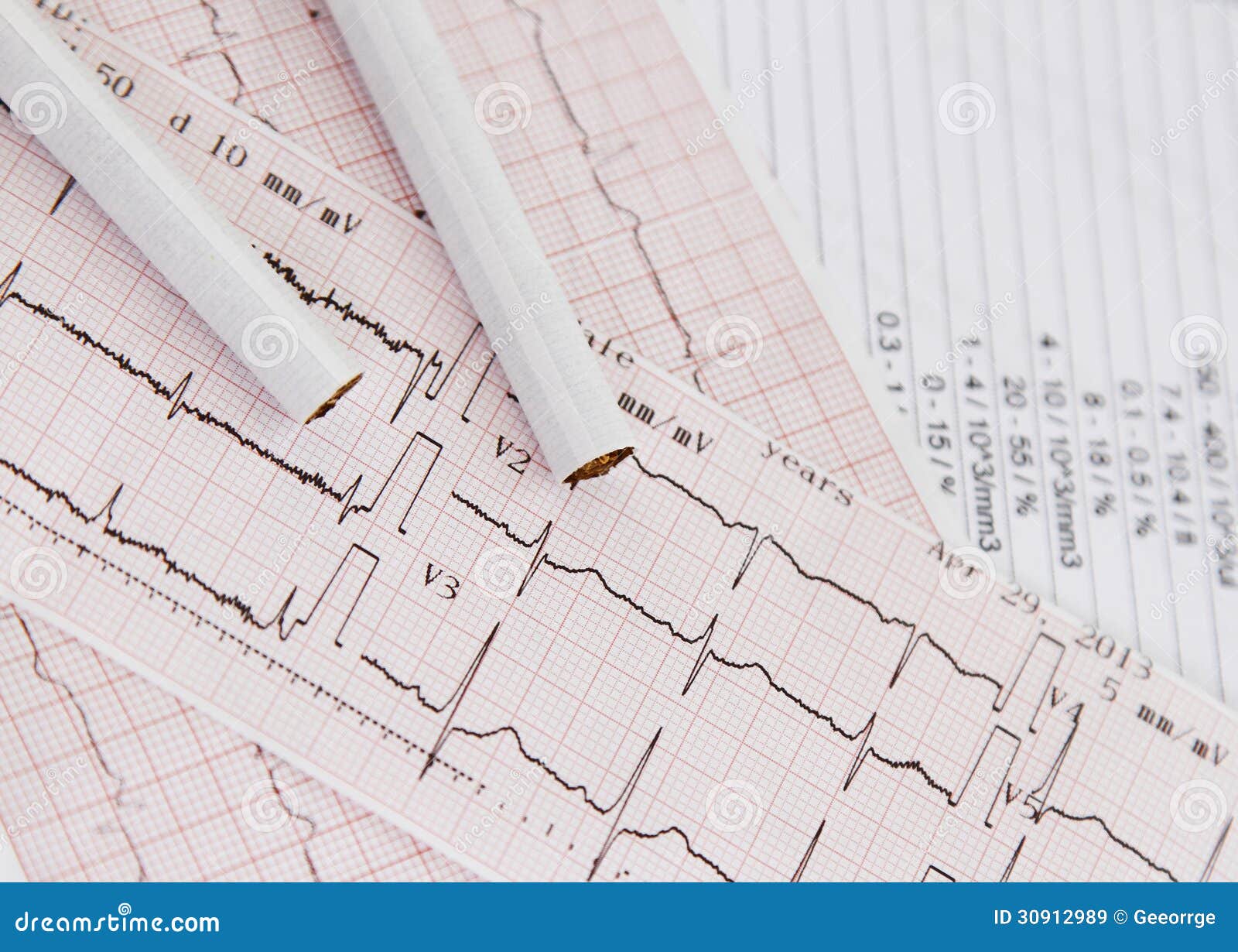 Heart Disease Caused by Cigarettes Stock Image - Image of cardiogram ...
