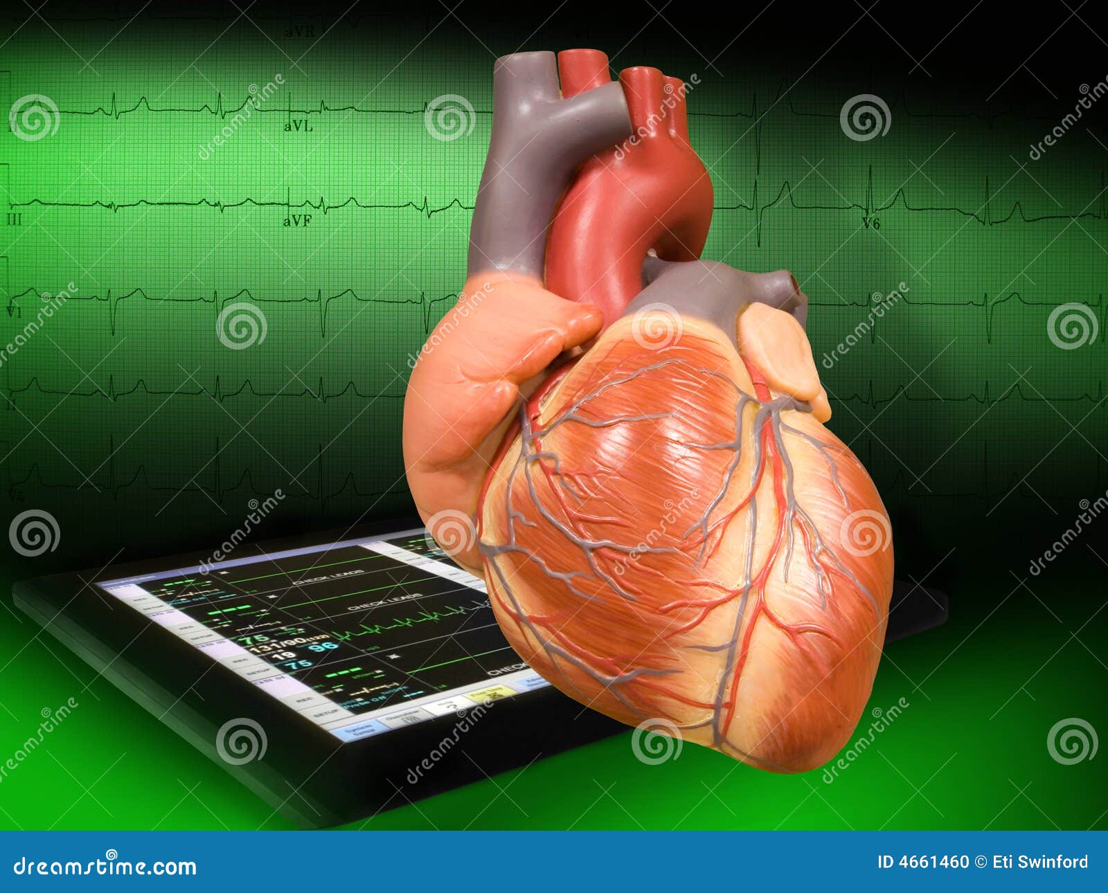Heart with EKG stock photo. Image of medical, heart, muscle - 4661460