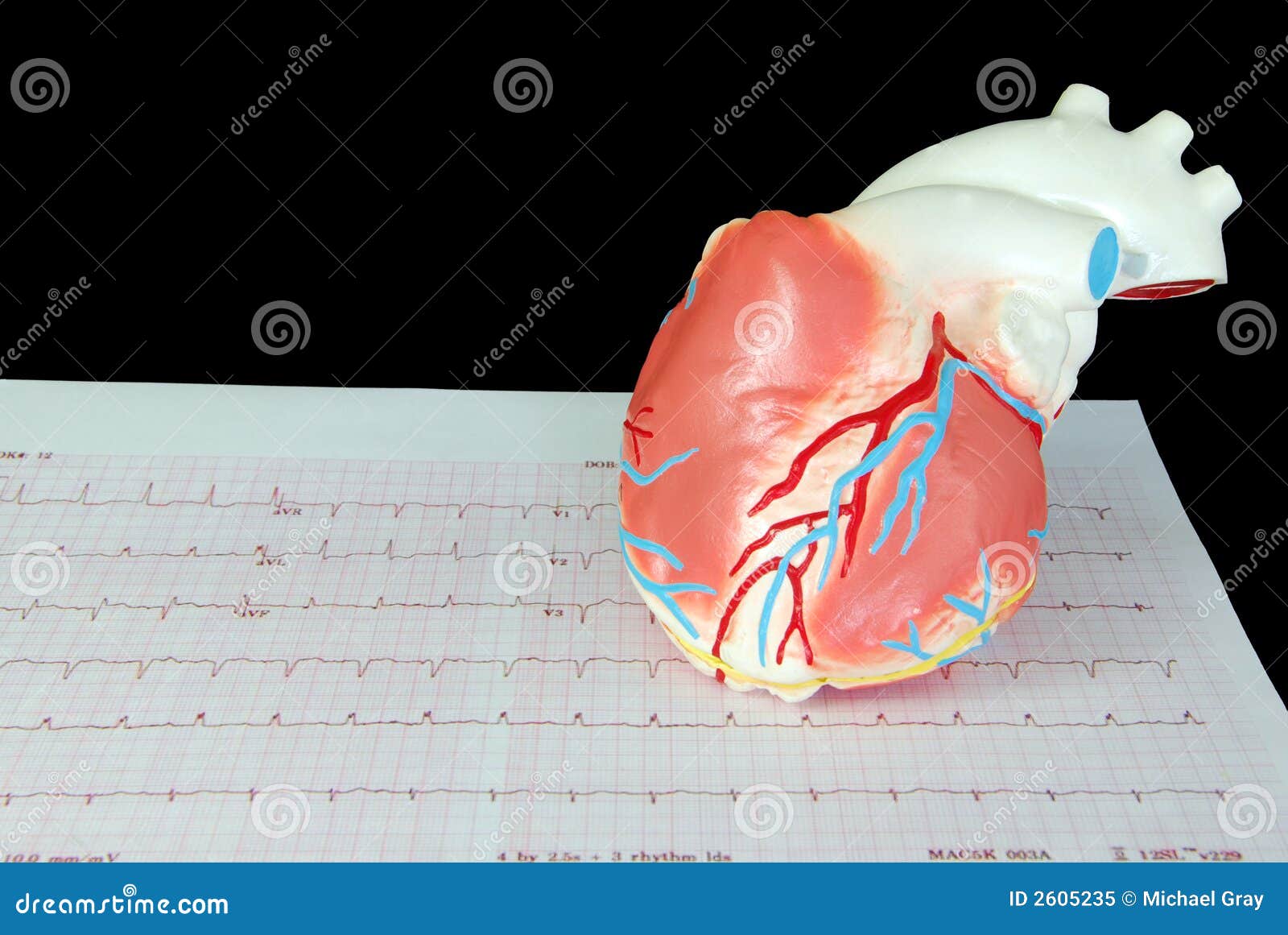 Heart on an Electrocardiogram Stock Image - Image of medicine, anatomy ...