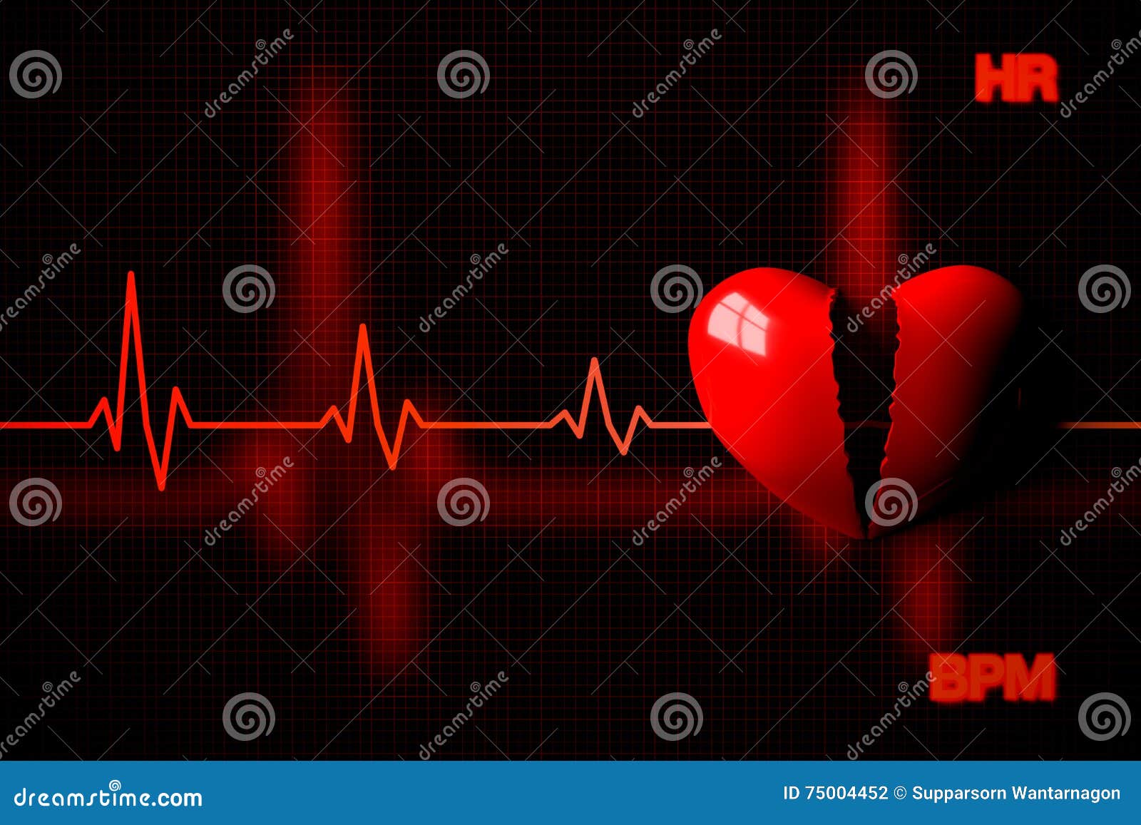 Heart Failure Concept Vector Illustration | CartoonDealer.com #215319170
