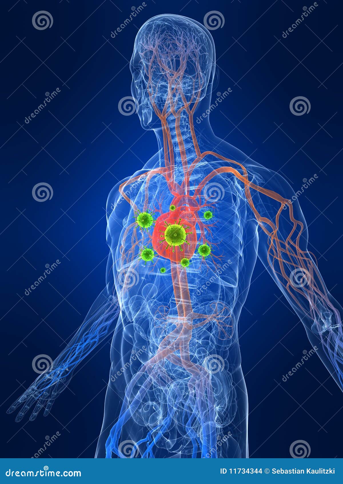 Heart infection stock illustration. Illustration of inflammation - 11734344