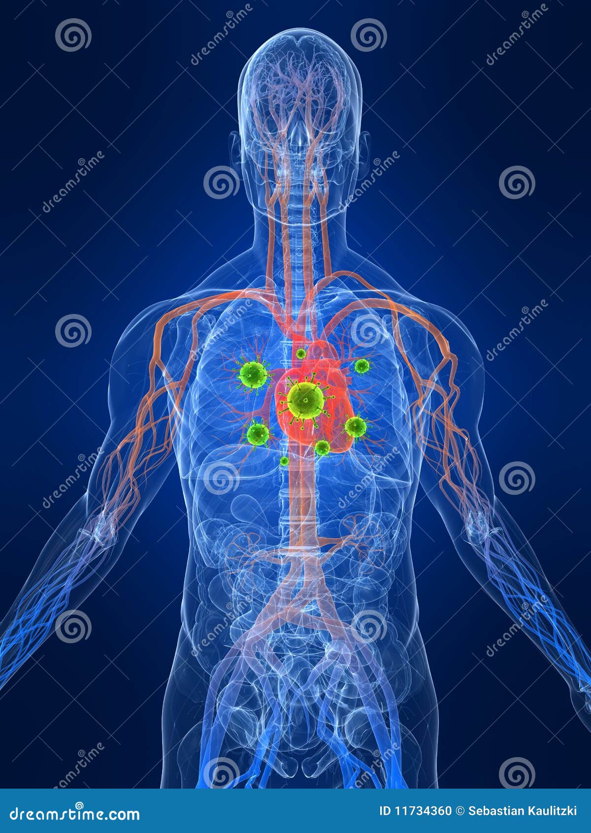Heart infection stock illustration. Illustration of heart - 11734360