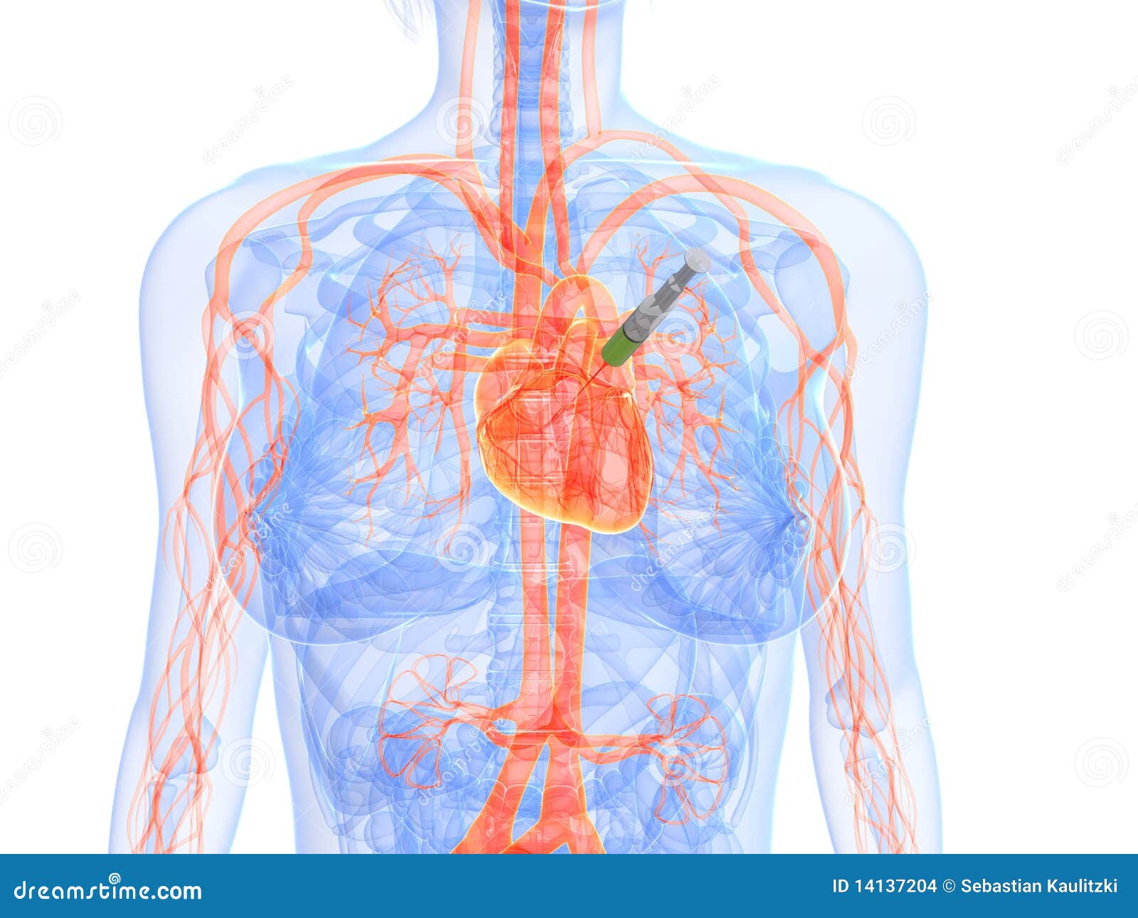 Heart injection stock illustration. Illustration of science - 14137204