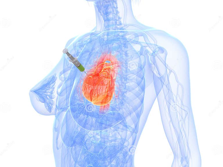Heart injection stock illustration. Illustration of attack - 14137267
