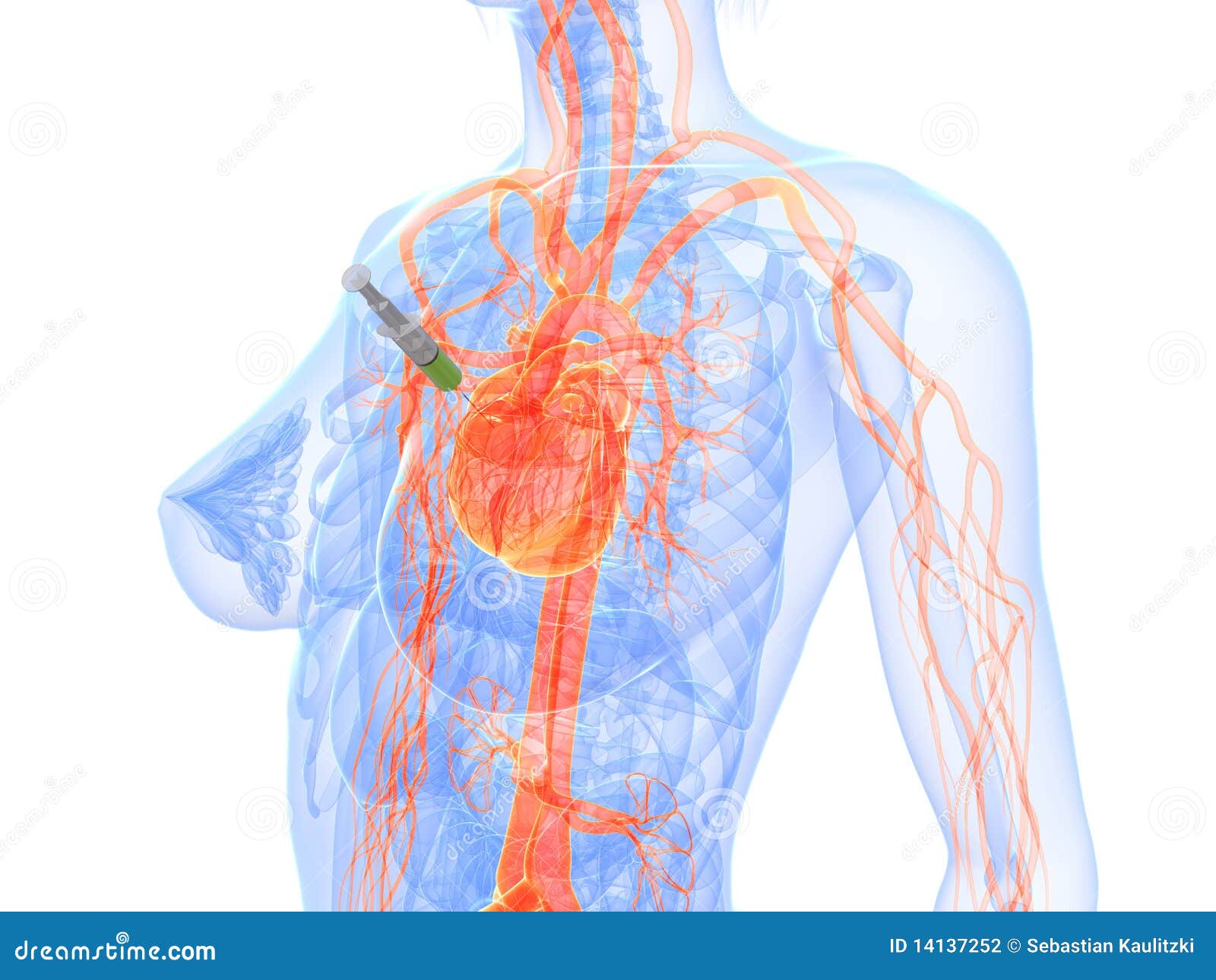 Heart injection - biopsie stock illustration. Illustration of ...