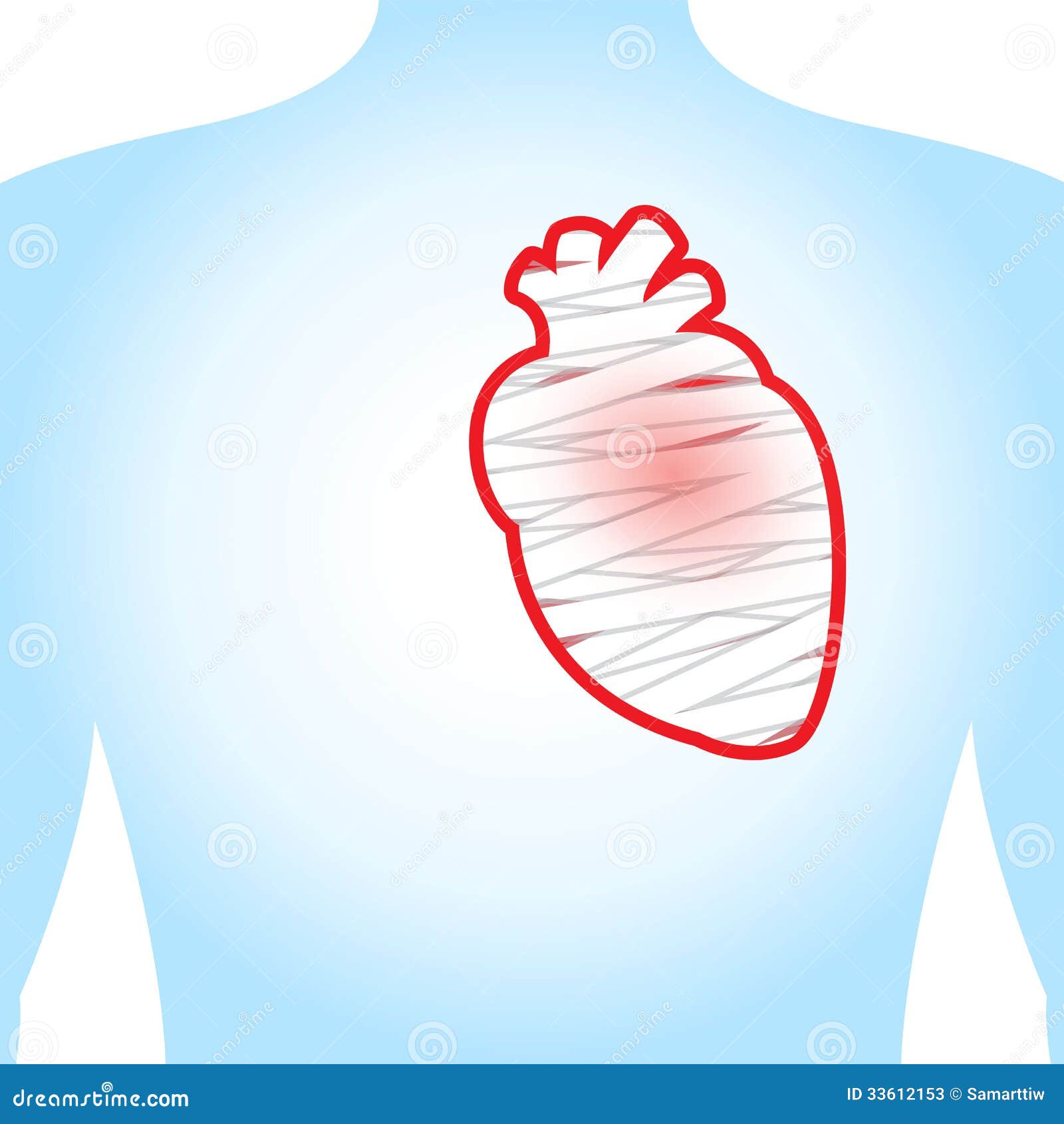 Heart injury. stock vector. Illustration of pain, sore - 33612153