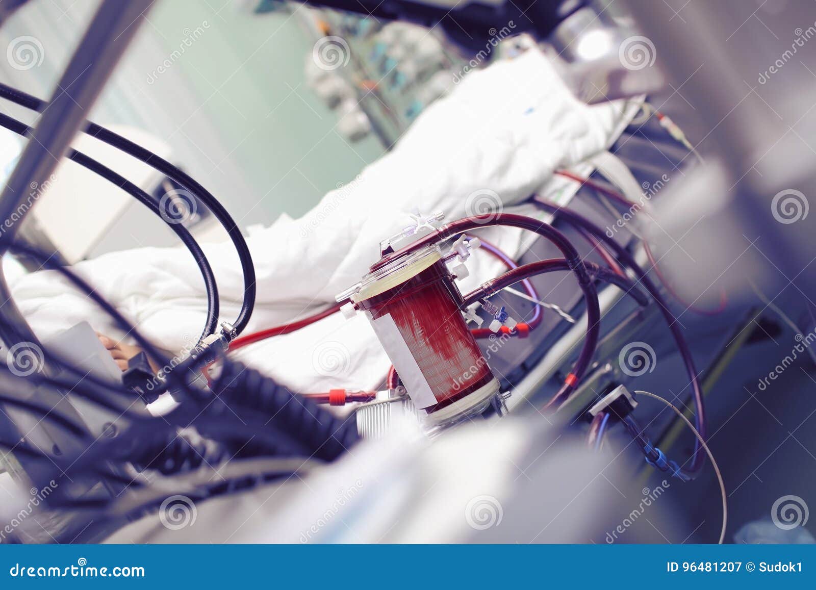 Heart-lung Machine Working in the ICU Stock Image - Image of appliance ...