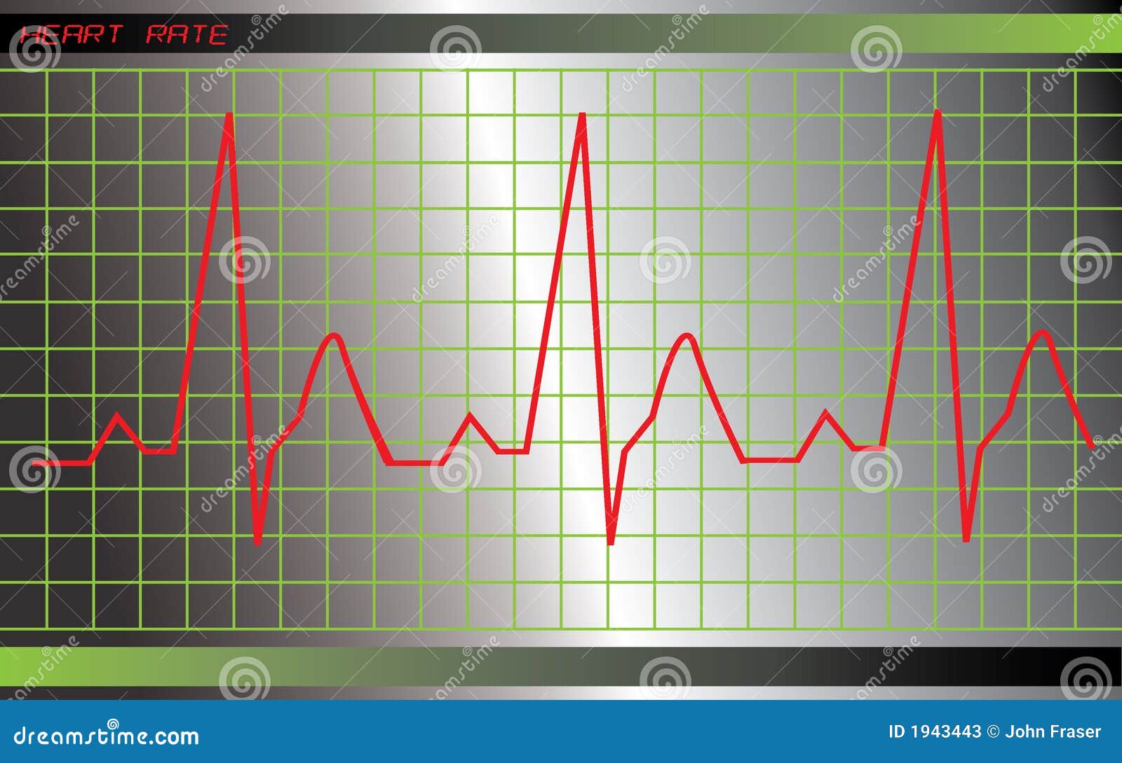 Heart Monitor stock illustration. Illustration of patient - 1943443