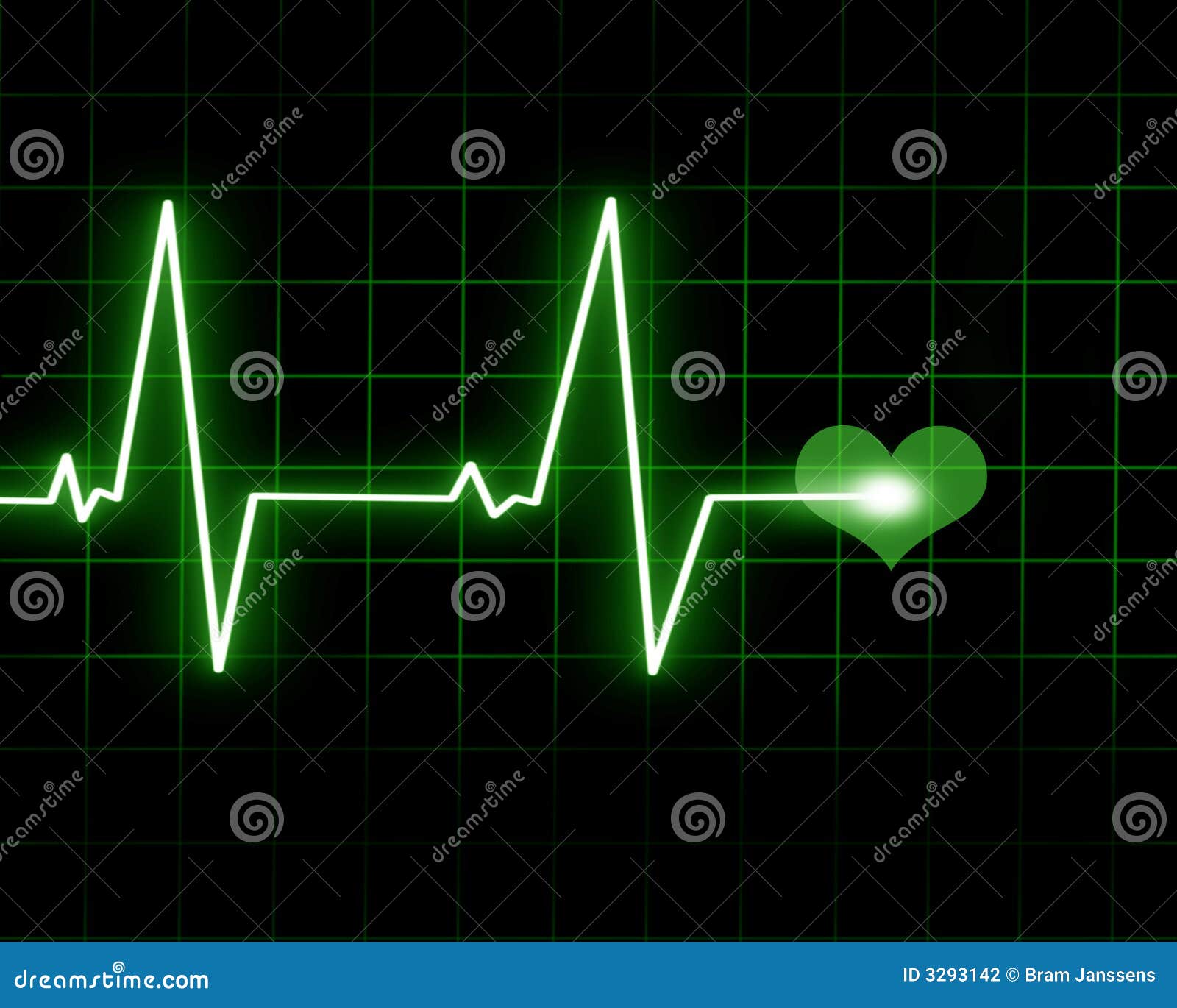 Heart monitor stock illustration. Illustration of cardiology - 3293142