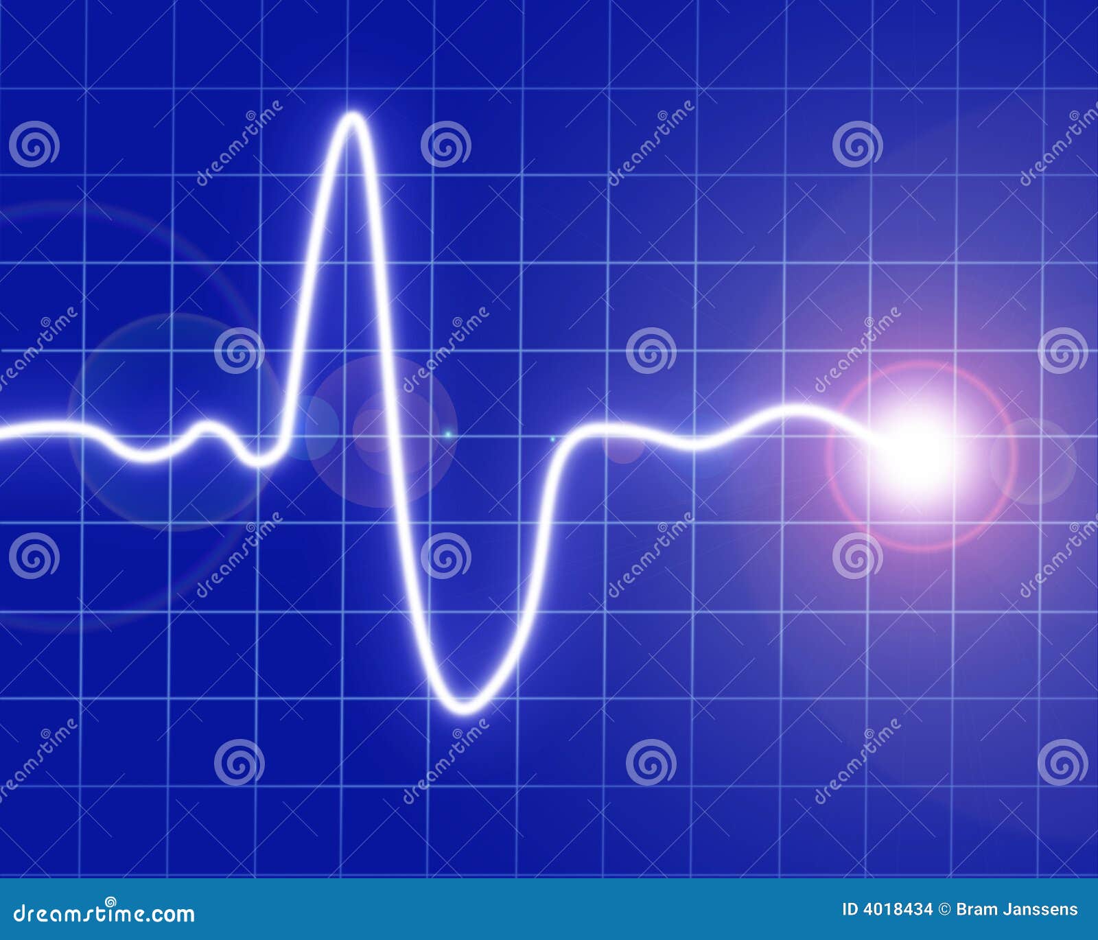 Heart monitor stock illustration. Illustration of medical - 4018434