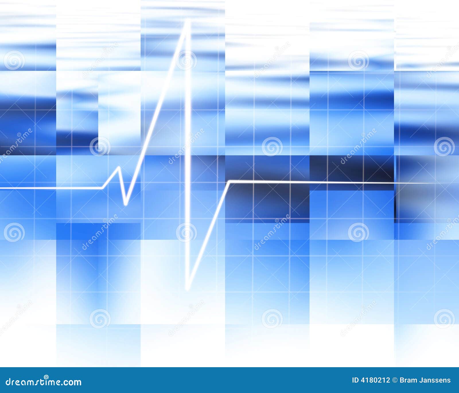 ECG Heart Monitor Cartoon Vector | CartoonDealer.com #34982401