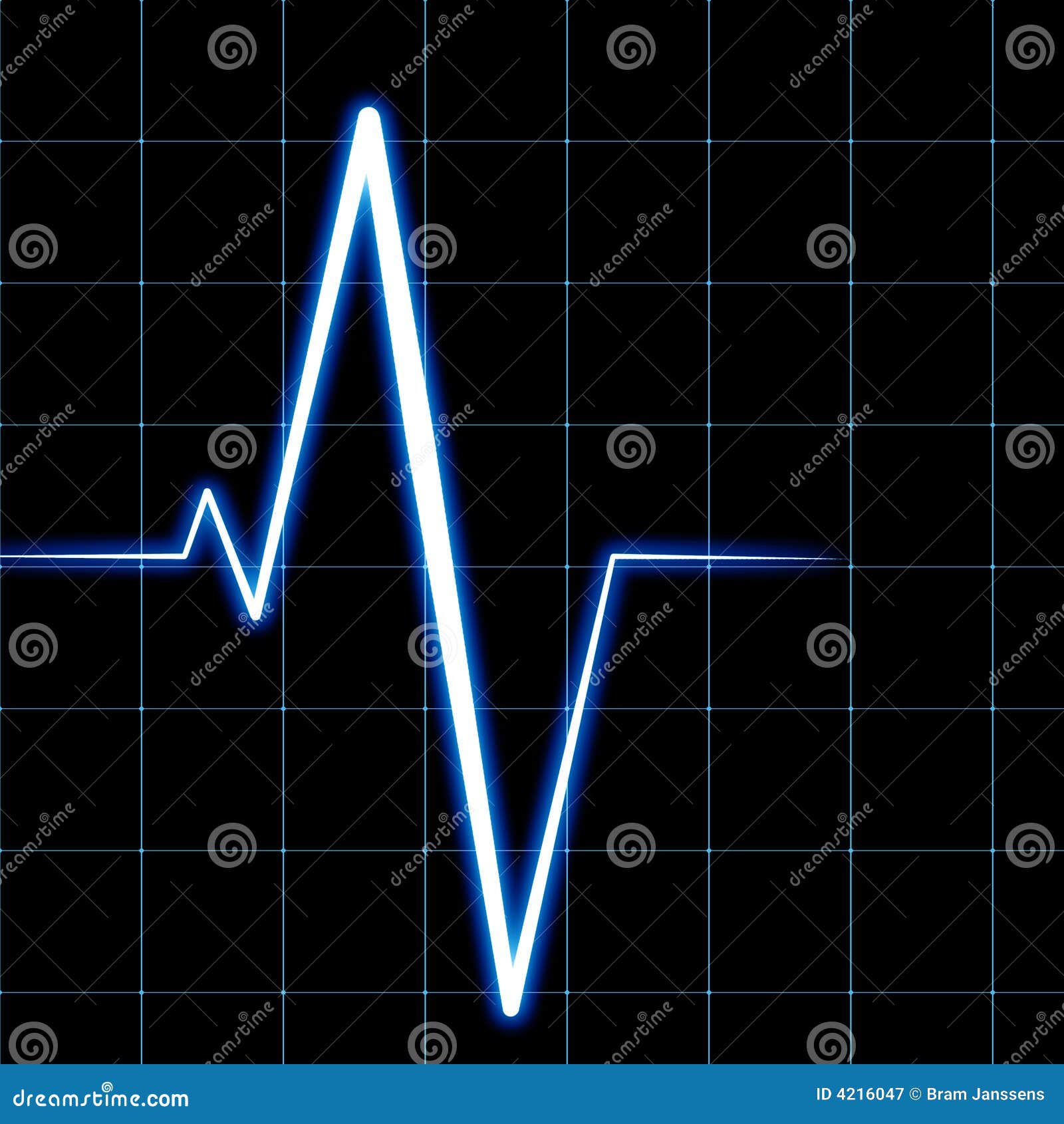 Heart monitor stock illustration. Illustration of monitoring - 4216047