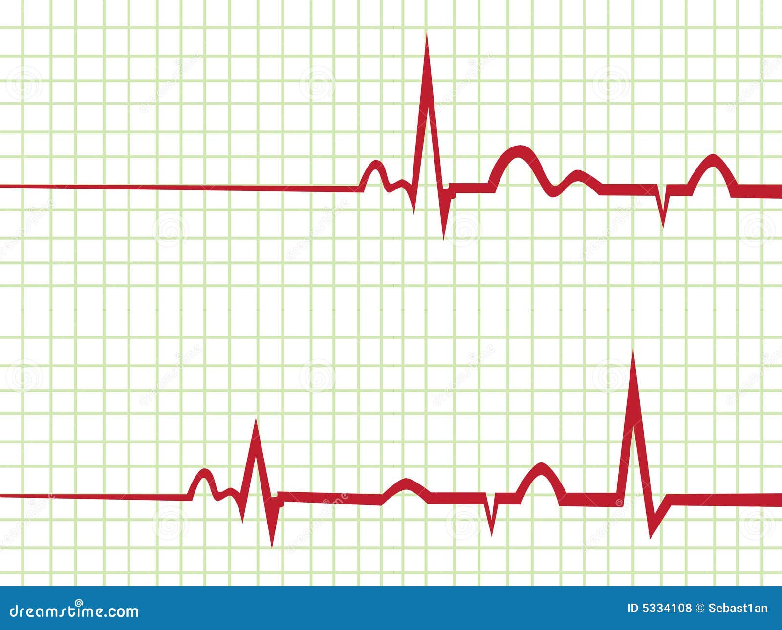 Heart monitor stock vector. Illustration of heart, cardiology - 5334108
