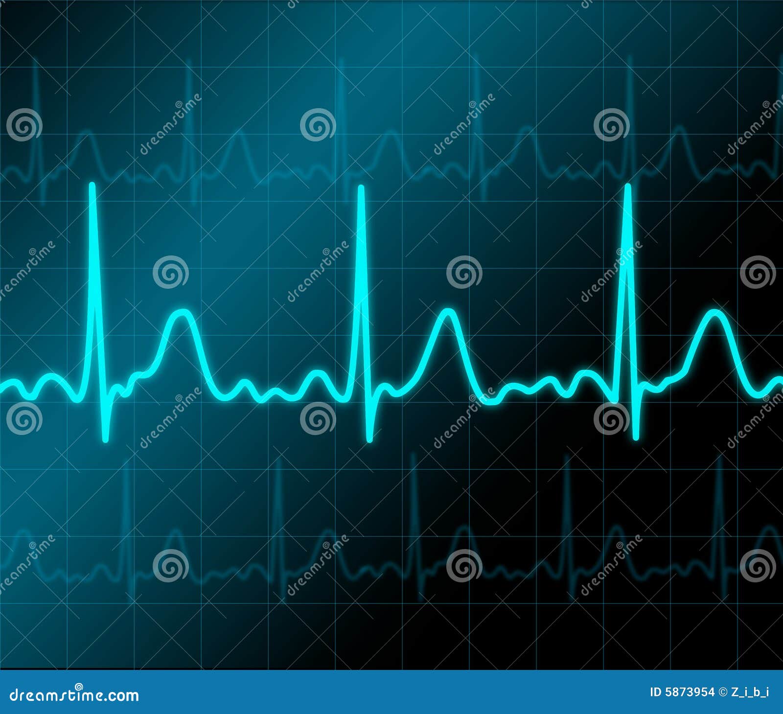 Heart monitor stock illustration. Illustration of cardiology - 5873954