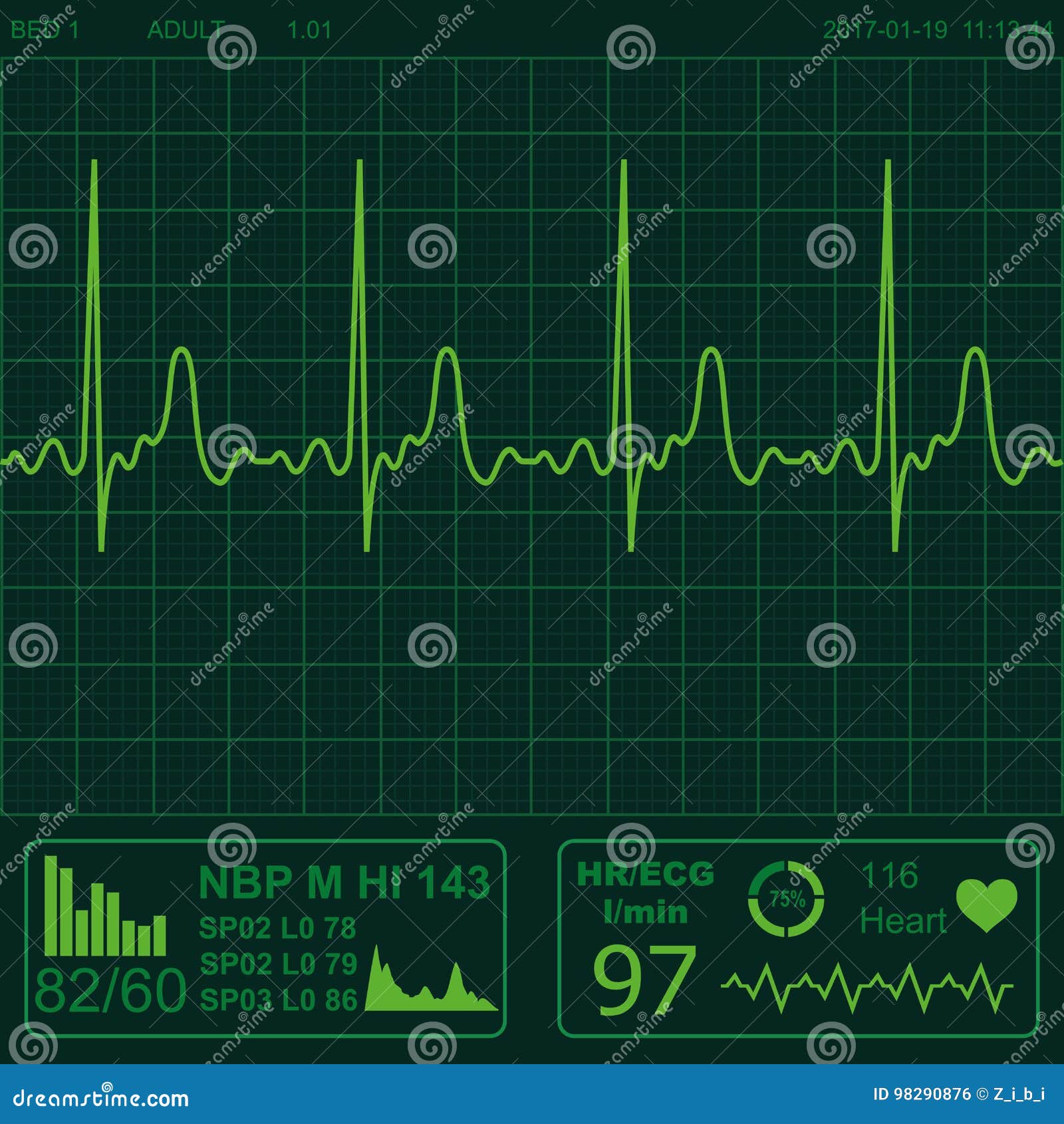 Heart monitor stock vector. Illustration of spike, rhythm - 98290876