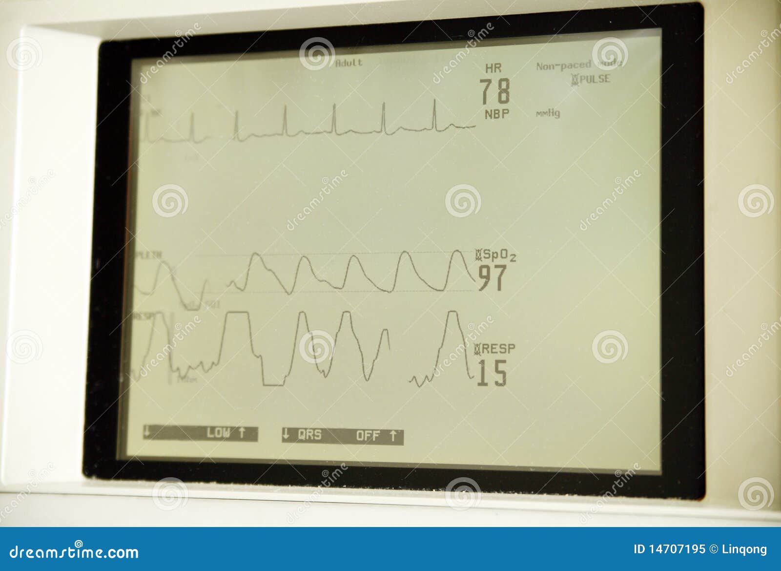 Heart monitor screen stock image. Image of clinic, hospital - 14707195