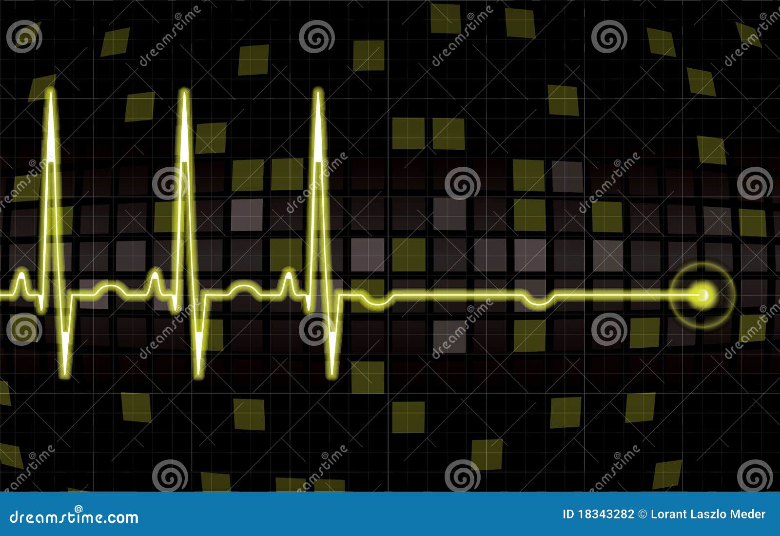 Heart monitor screen stock vector. Illustration of pulse - 18343282