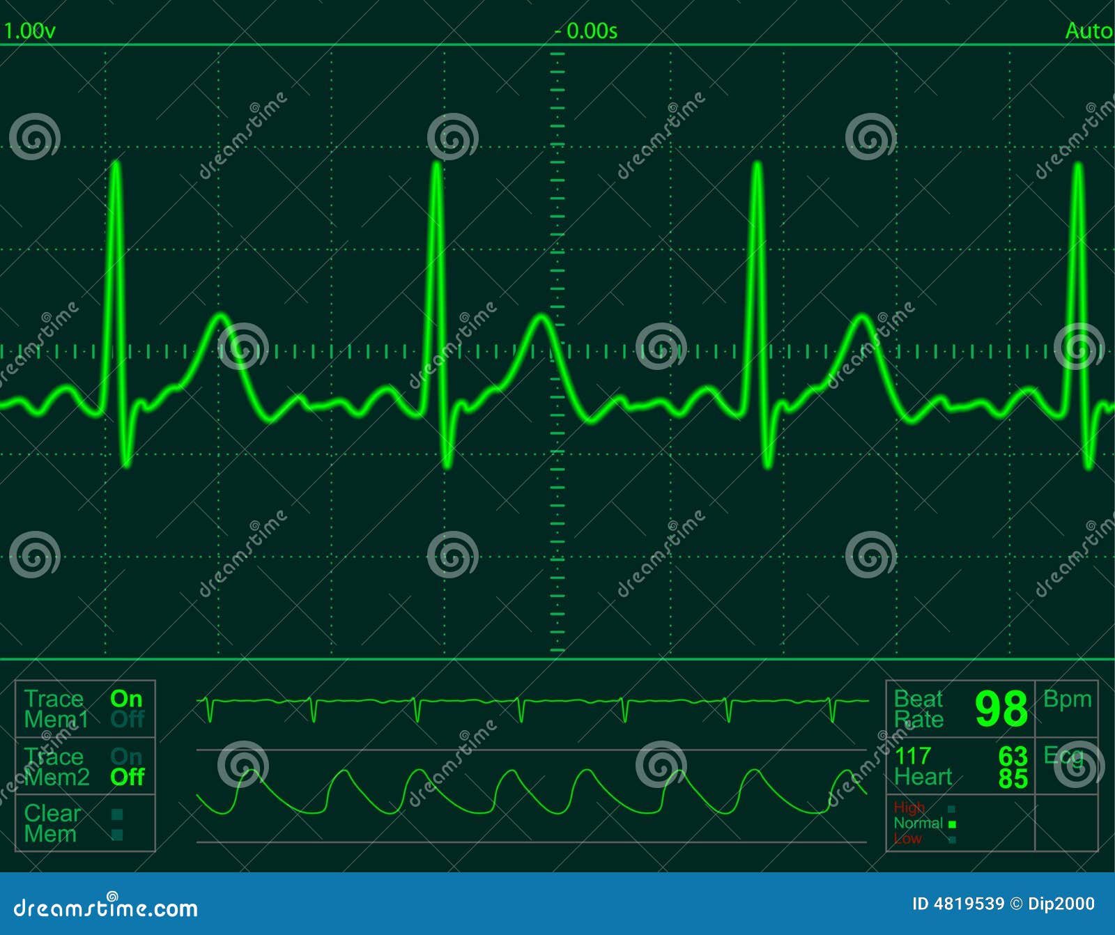 Heart monitor screen stock vector. Illustration of emergency - 4819539