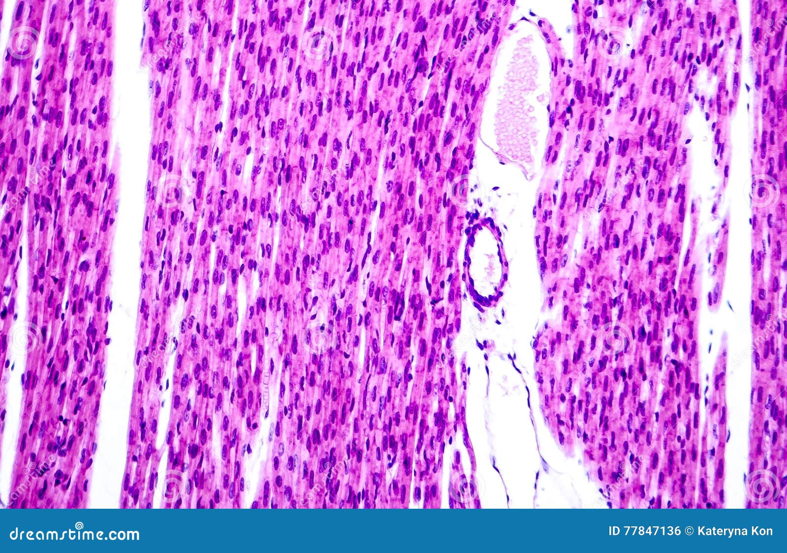 Heart Muscle, Light Micrograph Stock Photo - Image of cardiac, myocyte ...