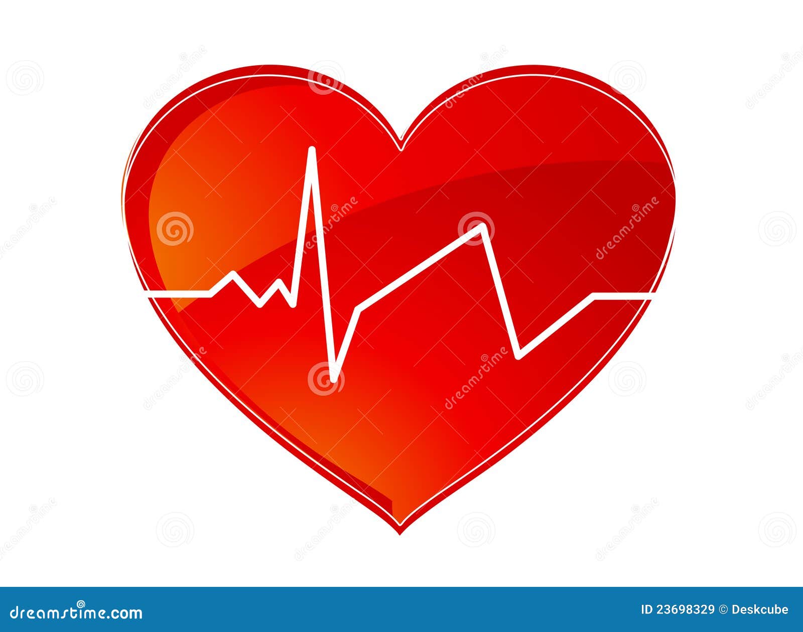 Abnormal Cardiogram Ventricular Tachycardia Cartoon Vector ...