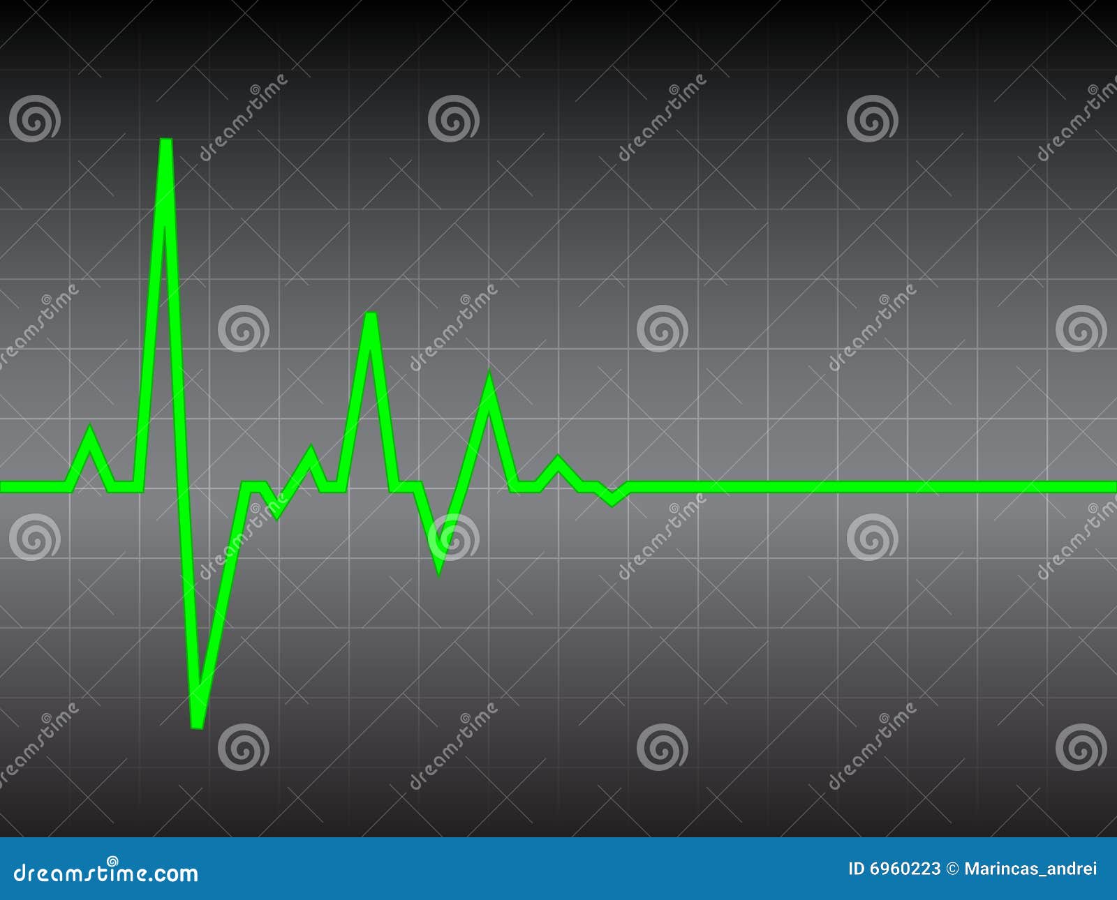 Heart With A Pulse. Vector Illustration. Examination Of The Patient ...