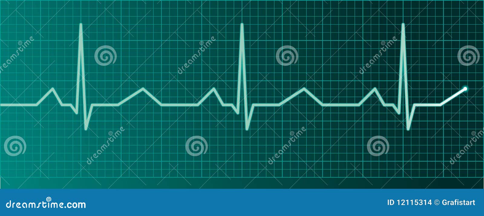 Heart Pulse Monitor Stock Illustrations – 23,671 Heart Pulse Monitor ...