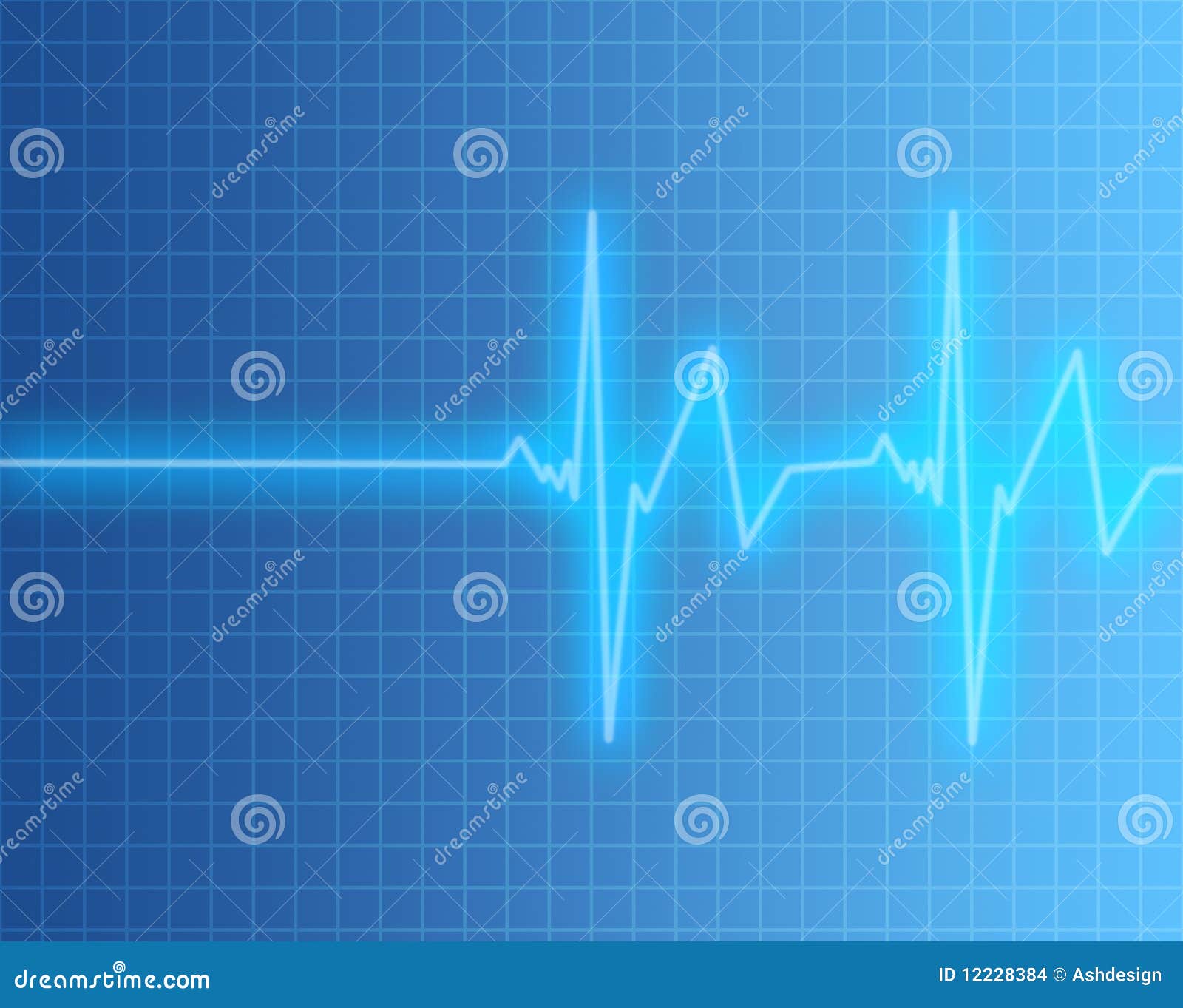 Heart Or Pulse Rate Screen Stock Photo | CartoonDealer.com #12228384