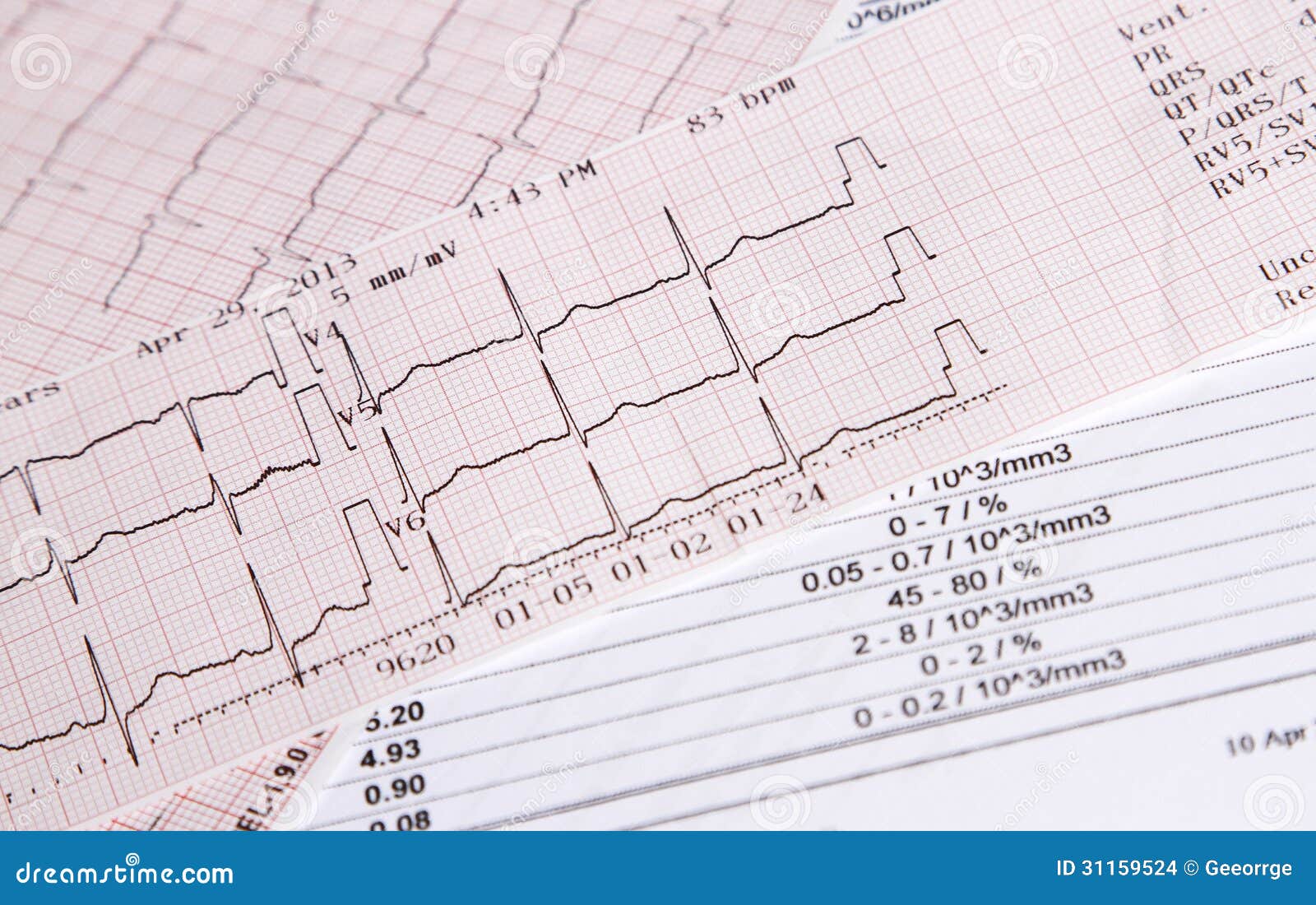 Heart rate control stock photo. Image of emergency, line - 31159524