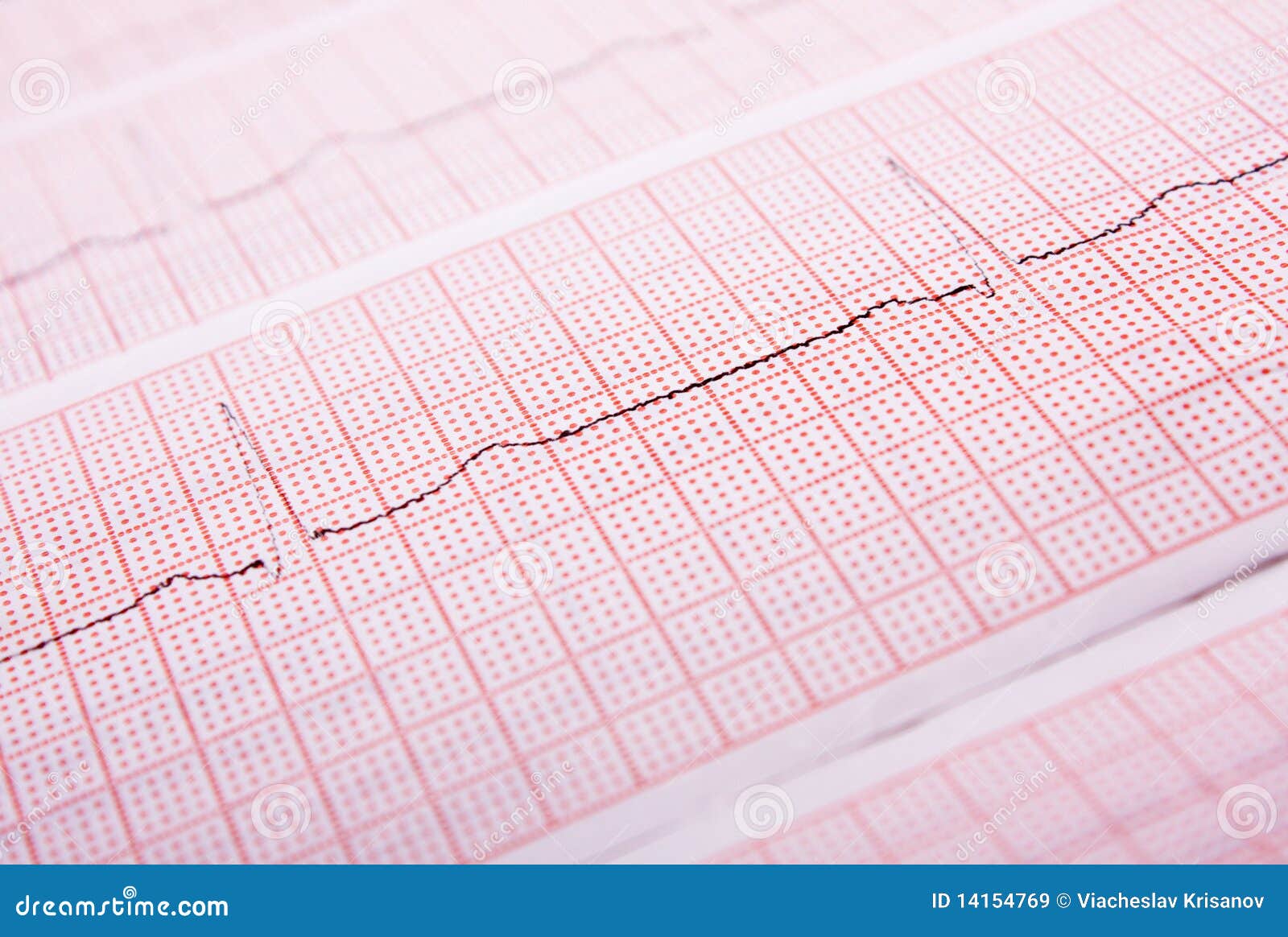 Heart Rate on Medical Print Out Stock Image - Image of healthcare ...