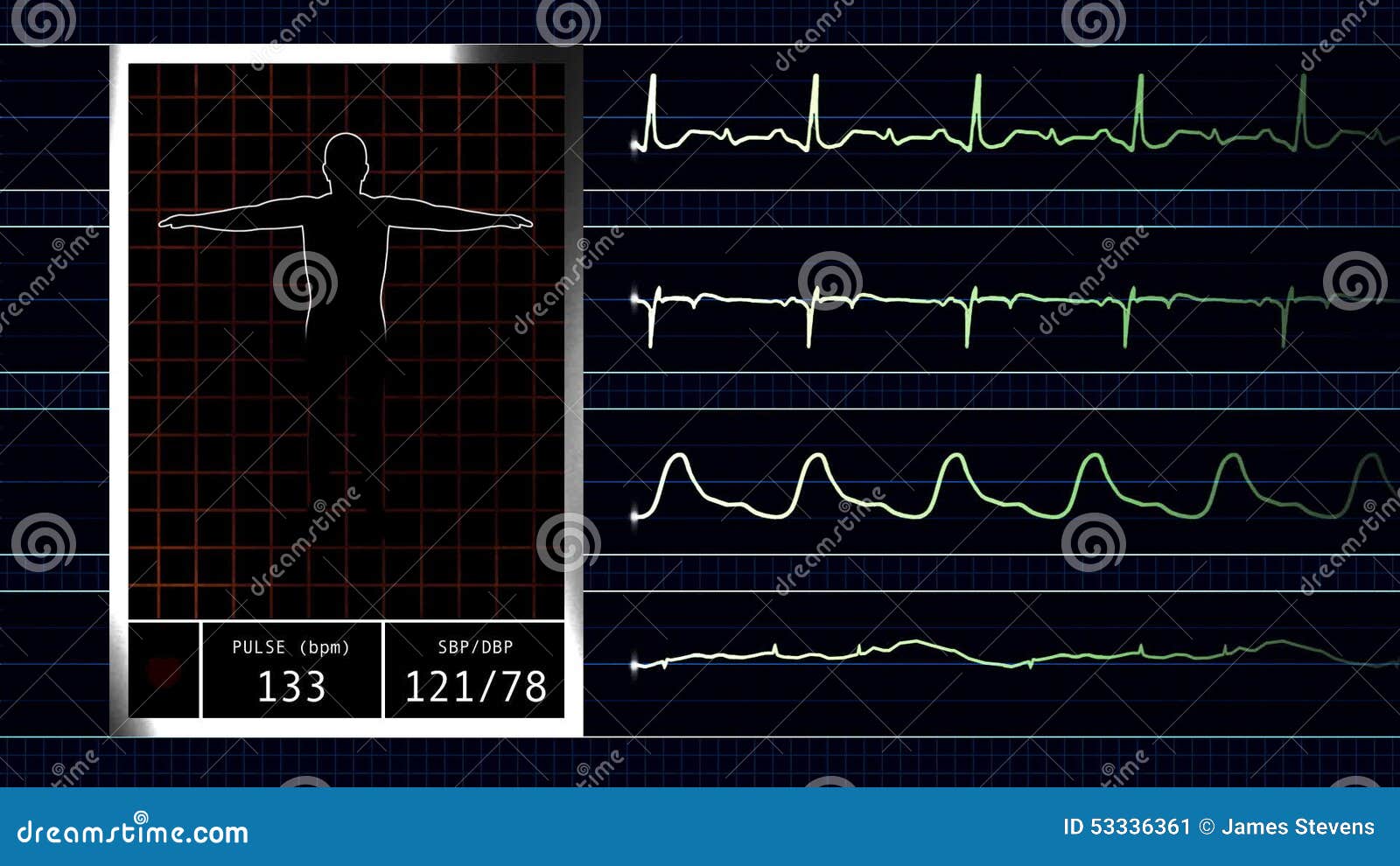 Heart Rate Monitor stock video. Video of medical, heart - 53336361