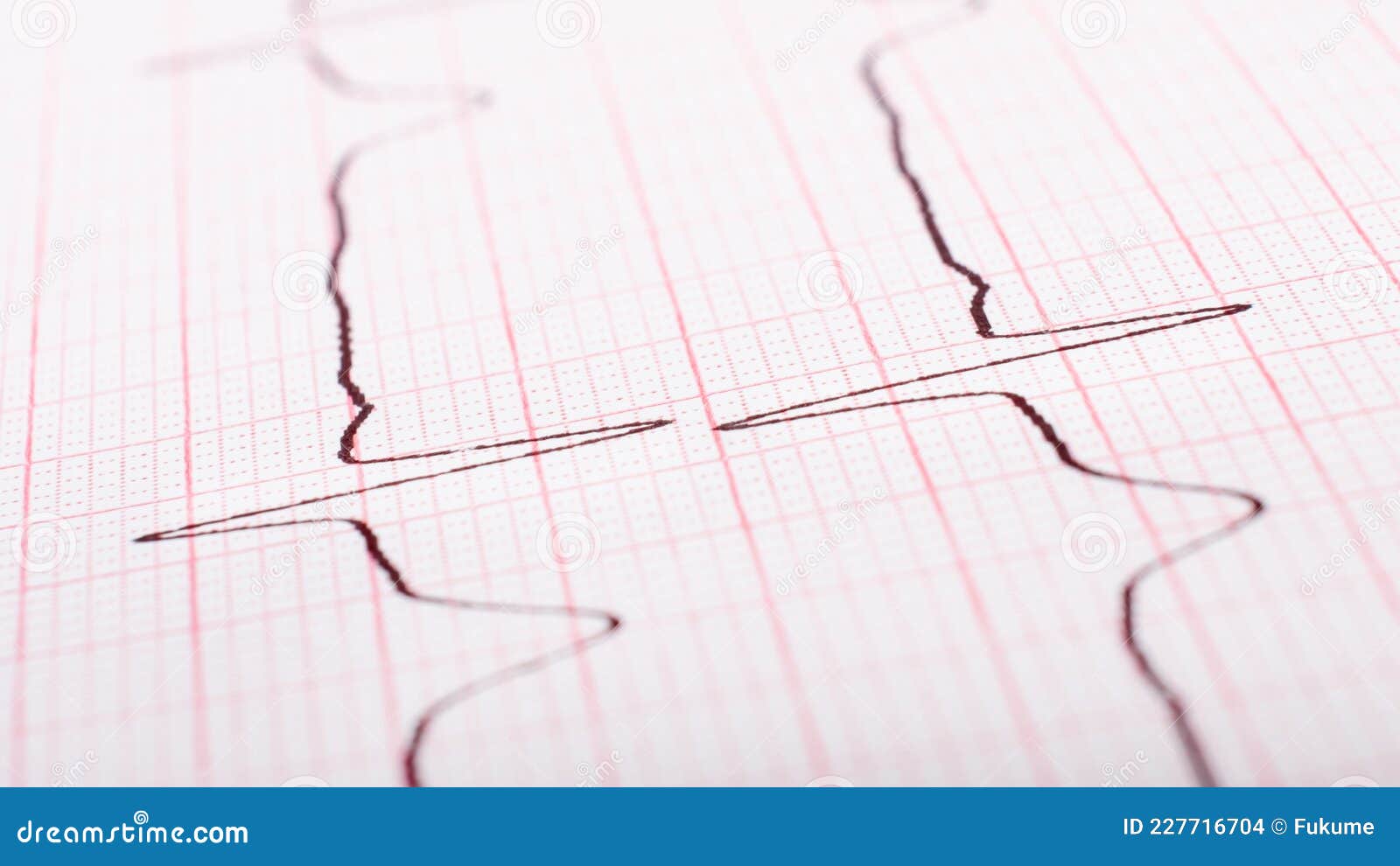 Heart Rate on Paper Cardiogram Closeup Stock Photo - Image of health ...