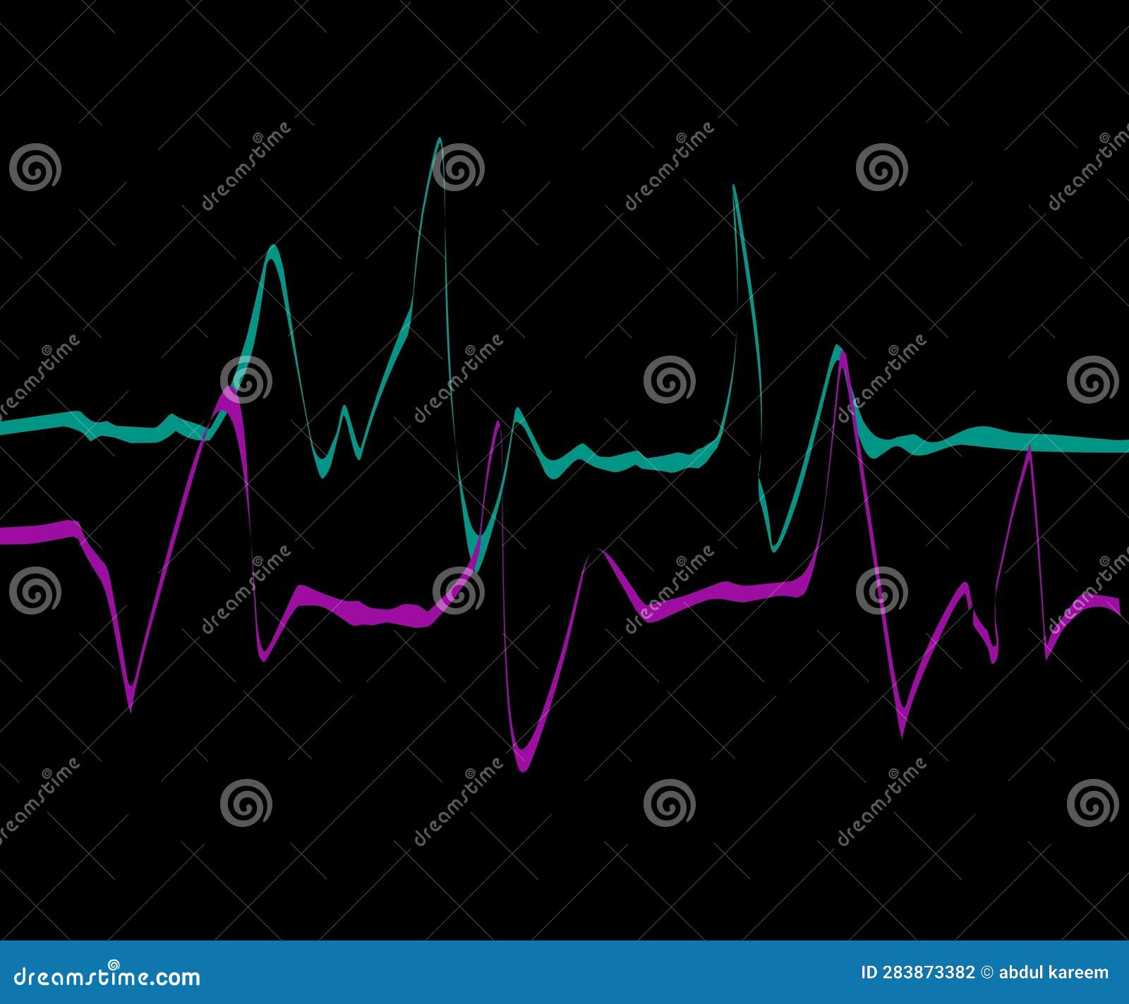 Heart Rate Pattern Diagram Illustration Stock Illustration ...