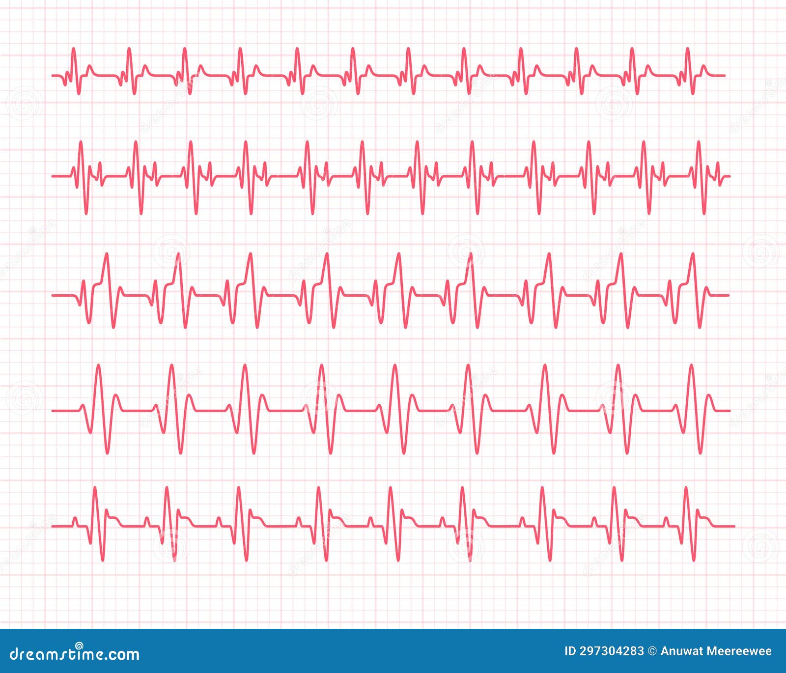Heart Rhythm Graph Checking Your Heartbeat for Diagnosis Stock Image ...