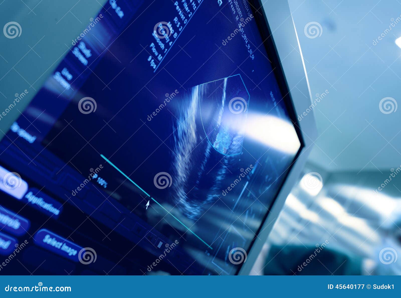 Heart on the Screen of Ultrasound Machine Stock Image - Image of ...