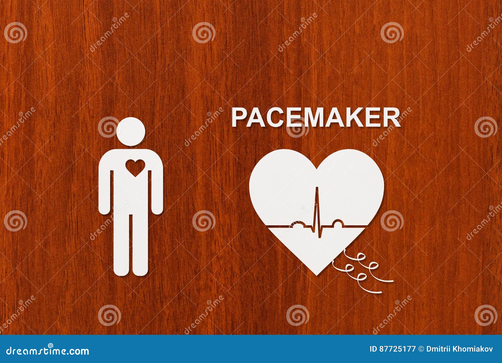 Pacemaker On Electrocardiograph Royalty-Free Stock Image ...