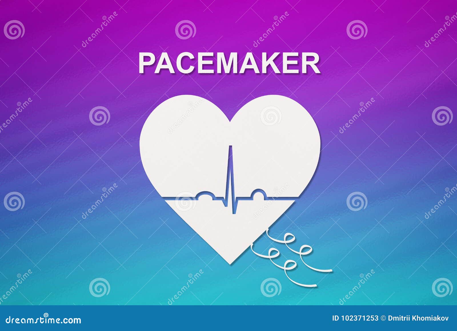 Pacemaker On Electrocardiograph Royalty-Free Stock Image ...
