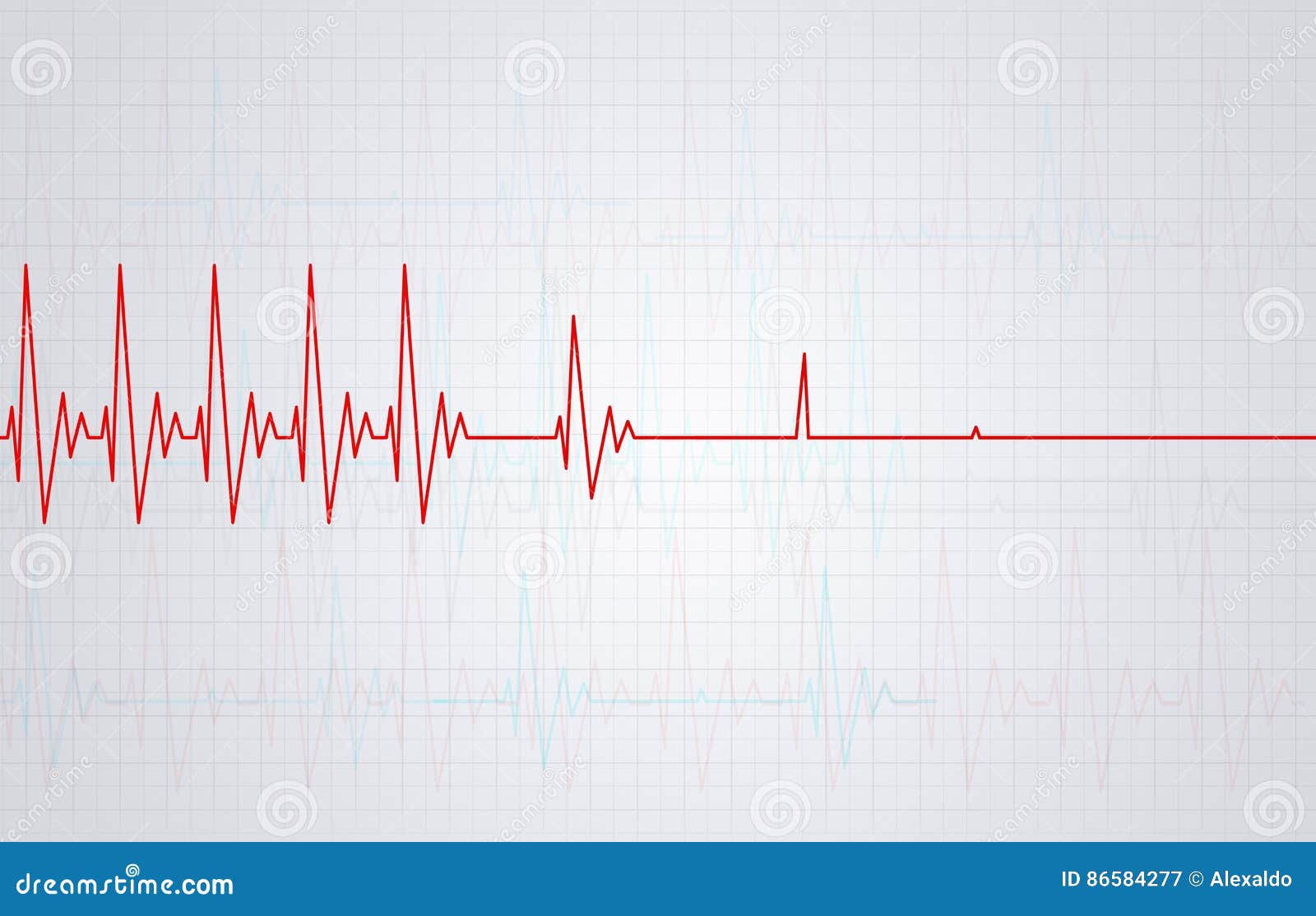 Heart Stops Pulsating Illustration Stock Illustration - Illustration of ...