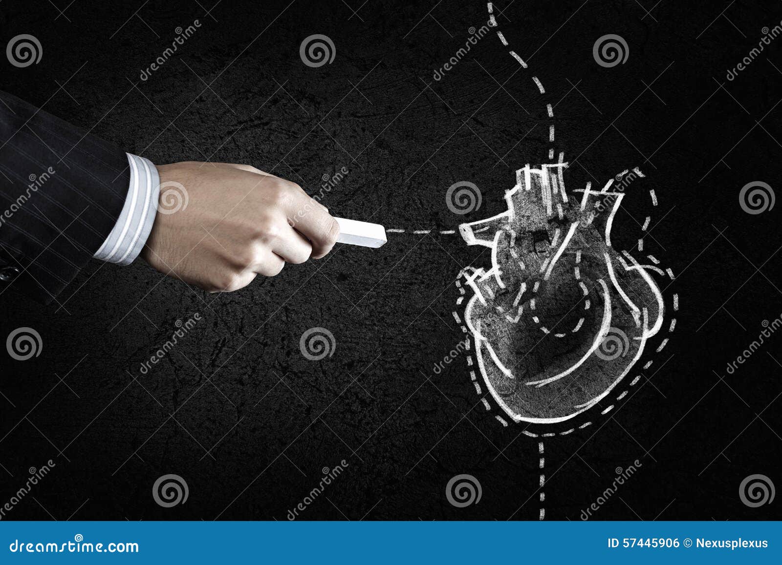 Heart surgery stock photo. Image of healthy, surgery - 57445906