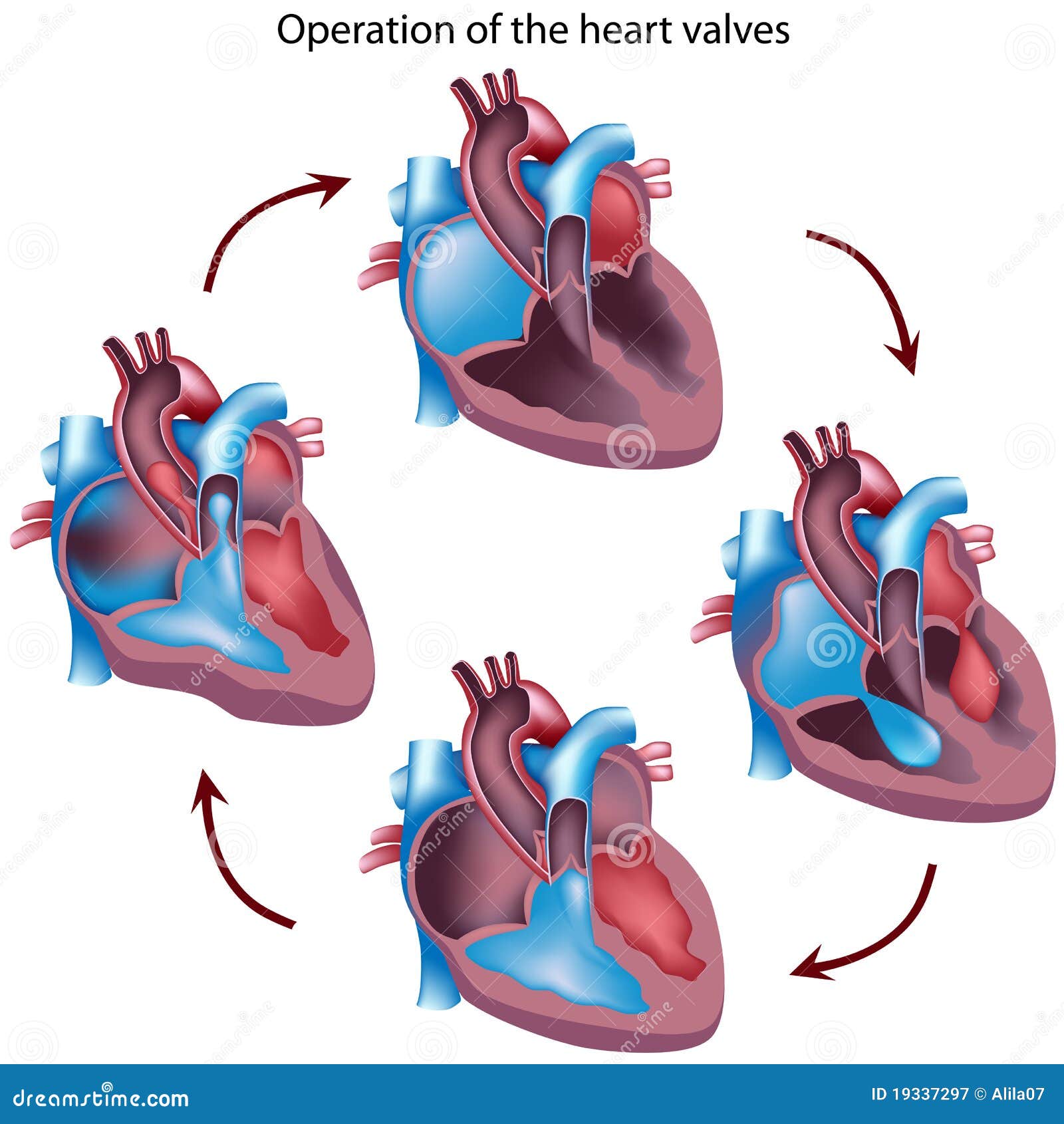 Heart valves operation stock vector. Illustration of cardiac - 19337297