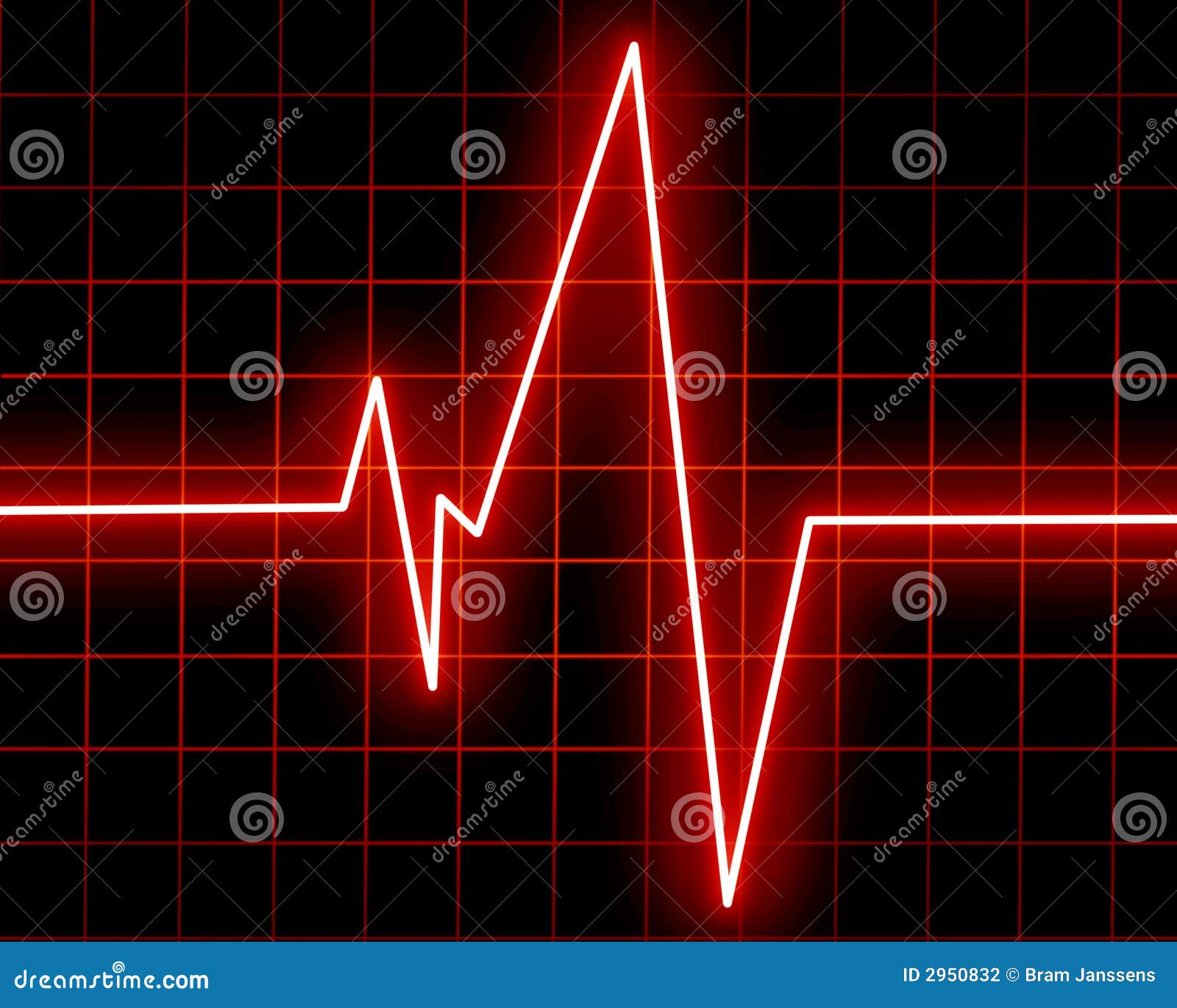 Heartbeat stock illustration. Illustration of medical - 2950832