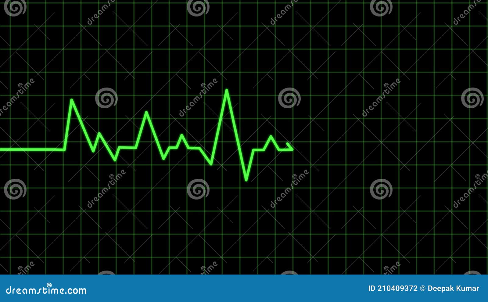 Heartbeat Medical Cardiogram Electrocardiogram Pulse Graph Stock ...