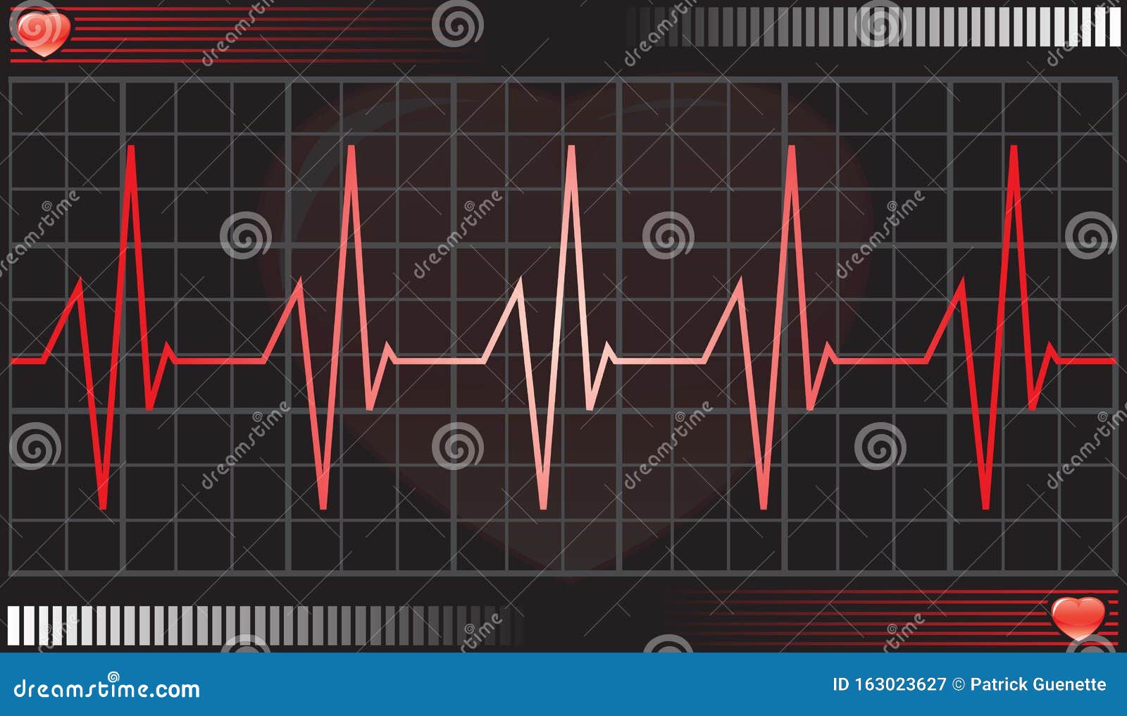 Heartbeat Monitor, Illustration Stock Illustration - Illustration of ...